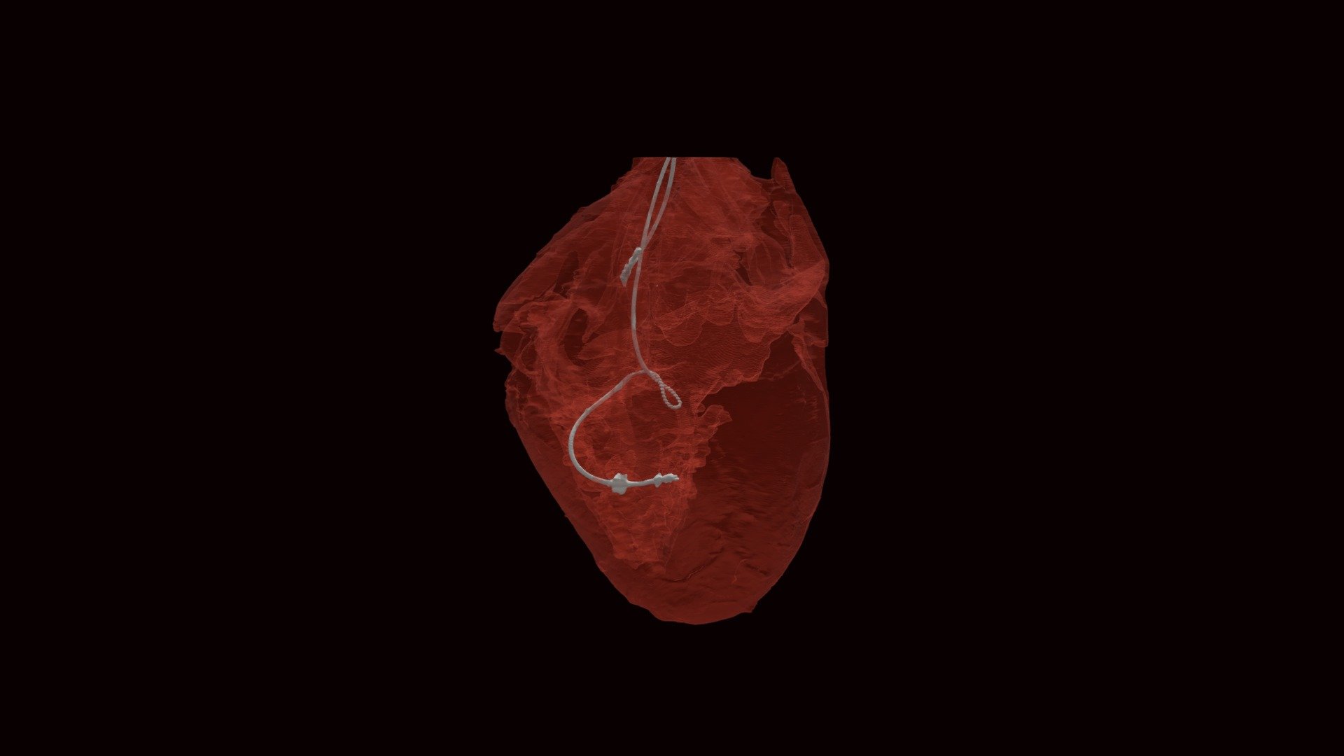 Heart0065 Elderly Male Heart with Pacemaker - Download Free 3D model by ...