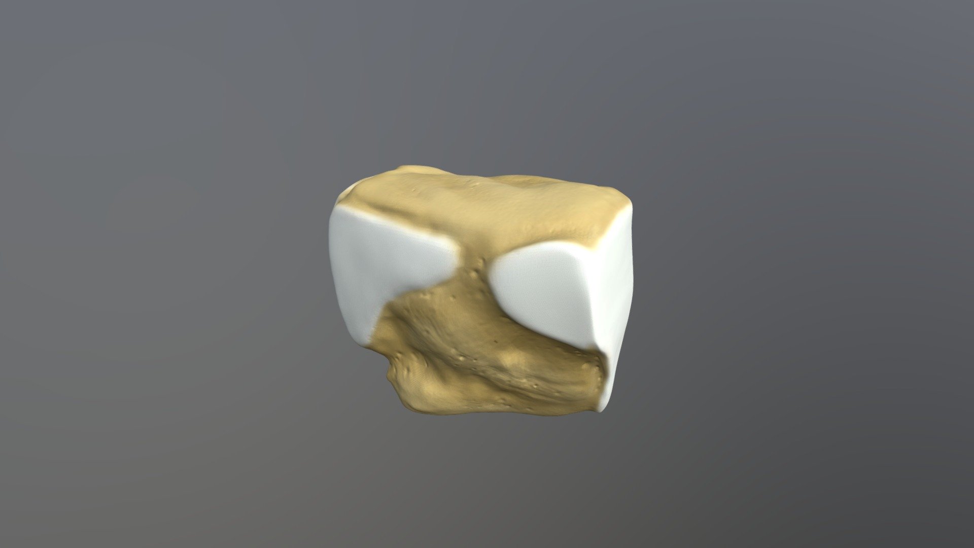 Lateral cuneiform - Buy Royalty Free 3D model by humantouchillustration ...