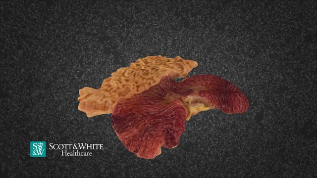 Jejunum 3D models - Sketchfab
