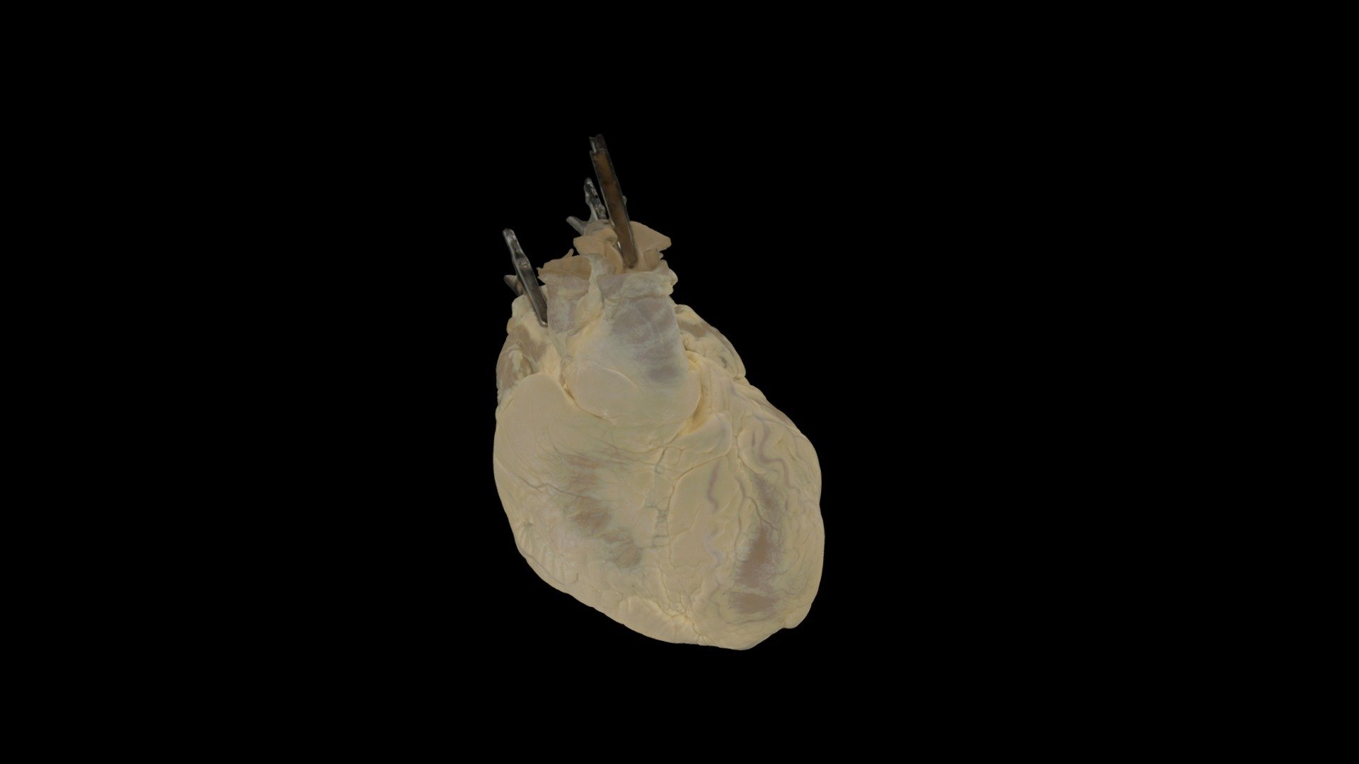 Human Heart Donation 94 - Download Free 3D model by VisibleHeartLabs ...
