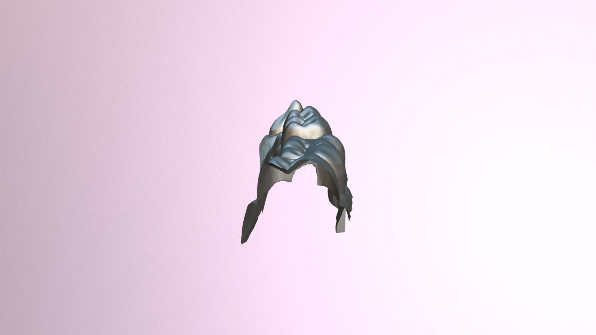 Onlay by Dr. Renne - 3D model by CADucation [f3f12fe] - Sketchfab