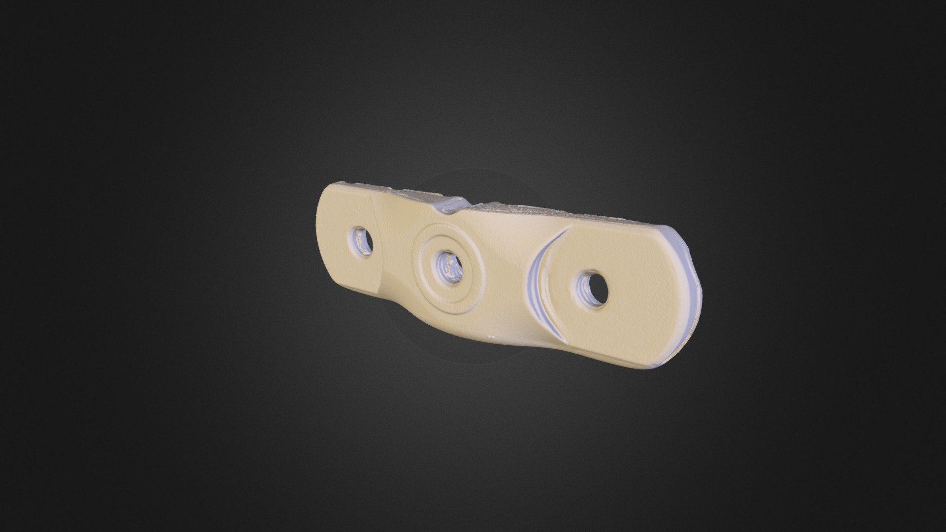 Ex Fix Plate Fusion 2 - 3D model by medscan [f4232c2] - Sketchfab