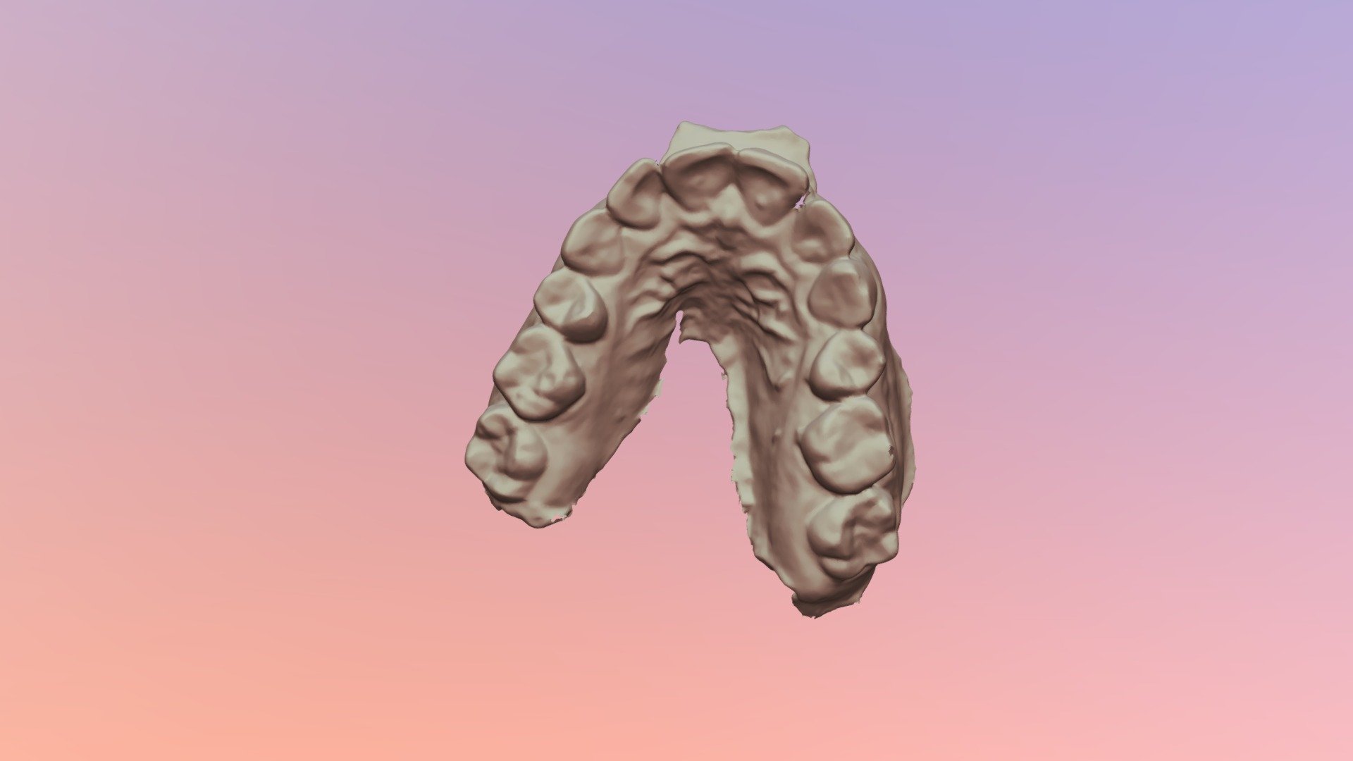 Tooth scan by Einscan Pro+ - 3D model by Blueprint 3D Budapest ...