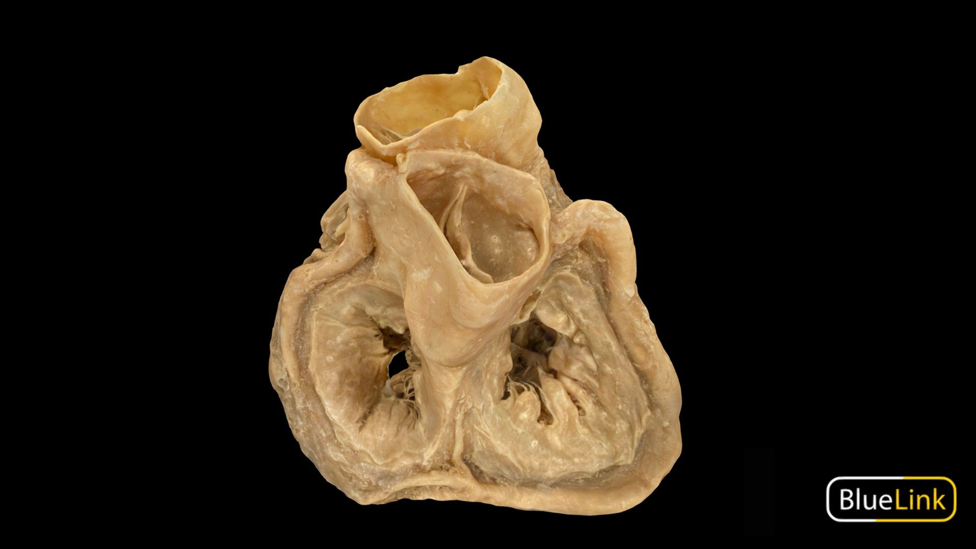 403 Heart Valves - 3D model by Bluelink Anatomy (@bluelinkanatomy ...