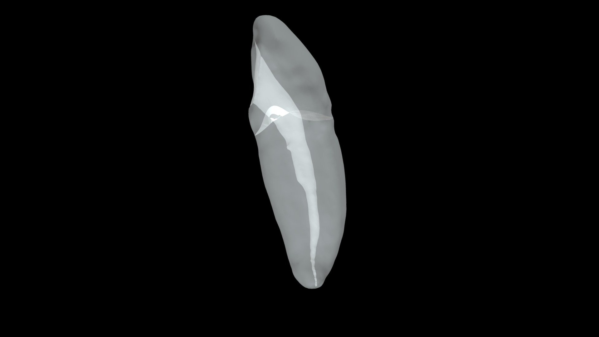 Tooth 6A Pre-Accessed - 3D model by biomed3d [f57a694] - Sketchfab