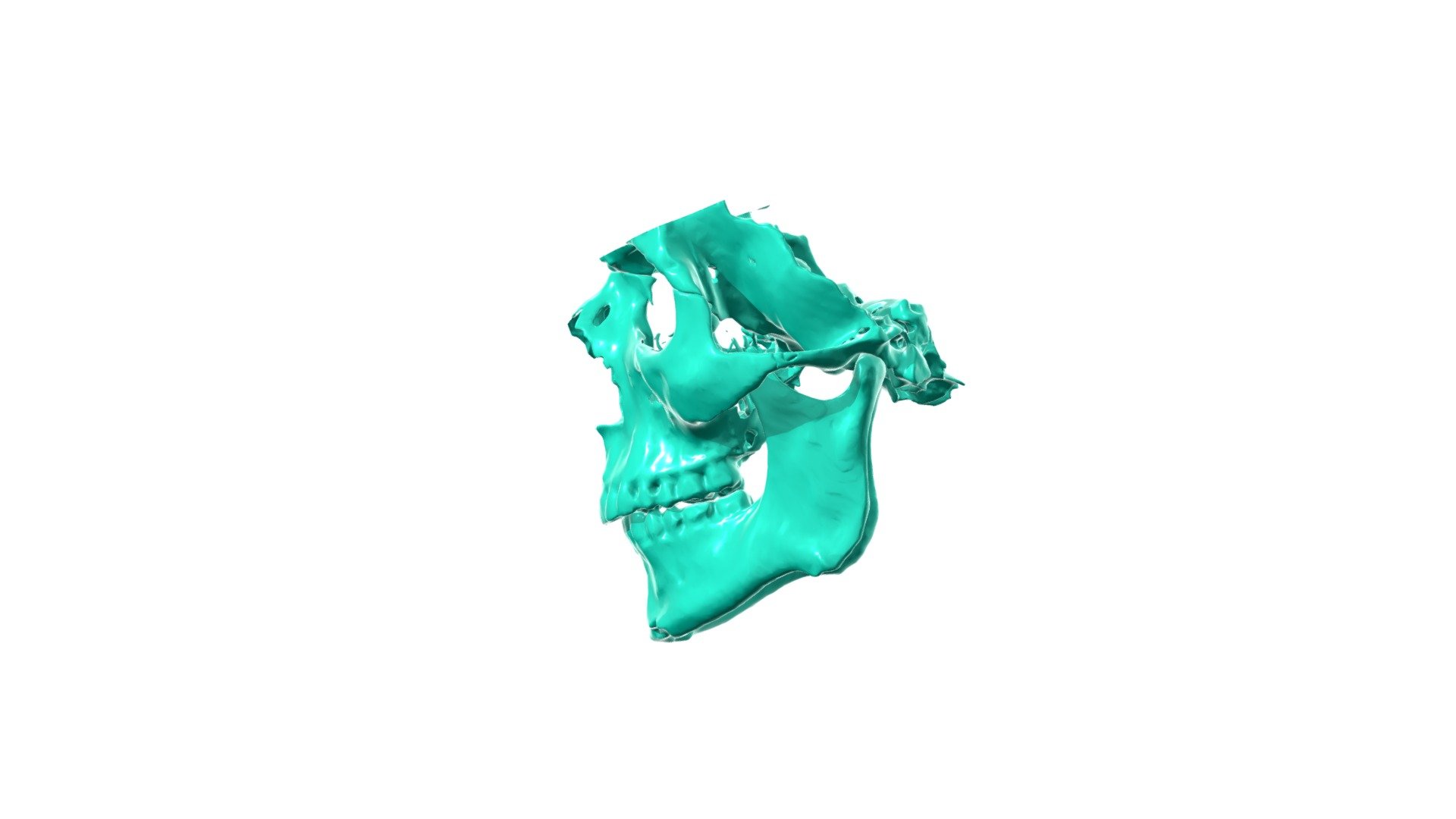 Skull from CBCT/DVT/DICOM scan - Download Free 3D model by anonuser321 ...
