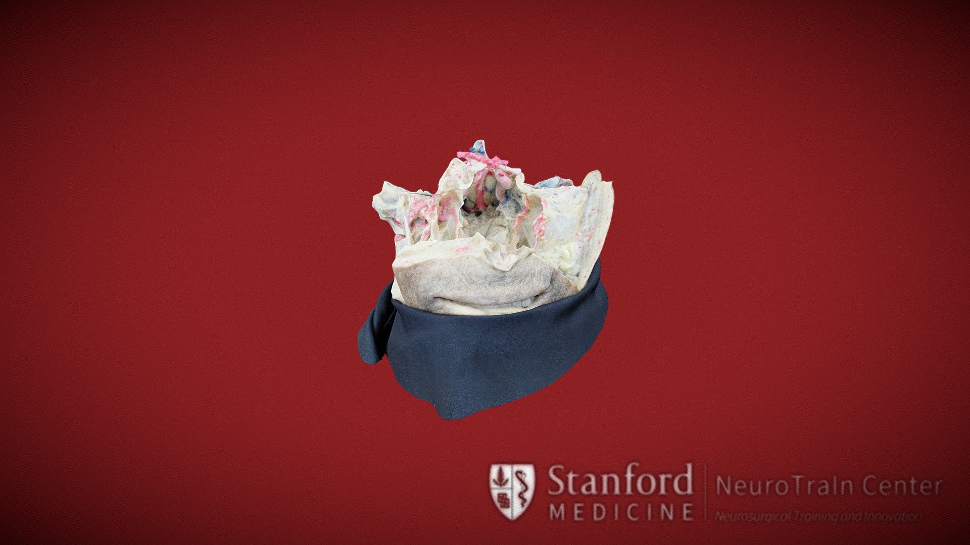 Cavernous Sinus and Posterior fossa - 3D model by vv (@verav) [f5a10a0 ...