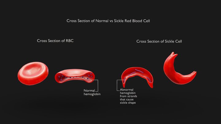 Hemoglobin 3D models - Sketchfab
