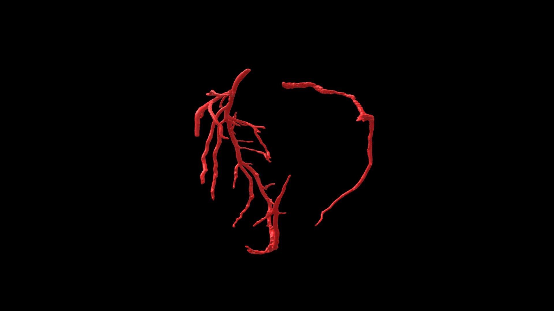 Heart0191 Coronary Arteries - Download Free 3D model by ...