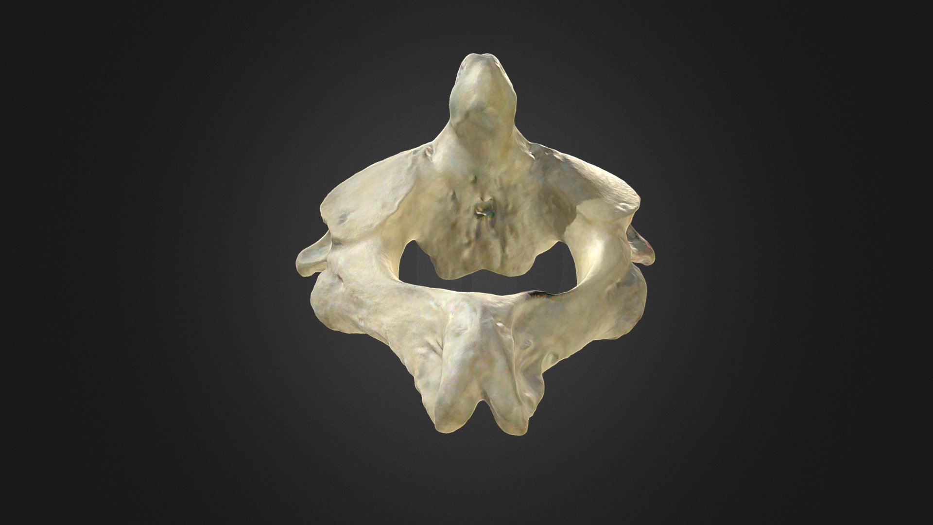 Axis - 3D model by Gonzalo Matzner (@Anatomical3DModels) [f692b99 ...