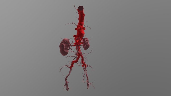 Aorta 3D models - Sketchfab