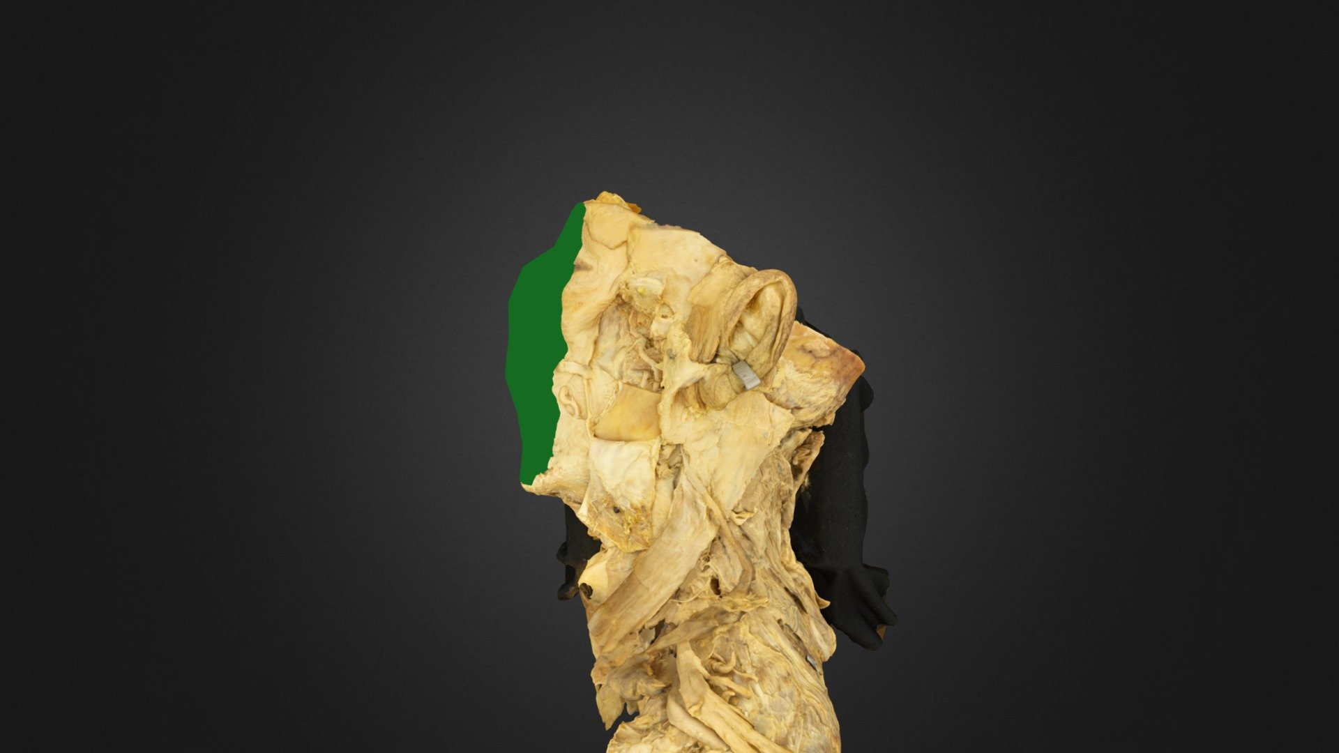 Muscles Of Mastication Deep - 3D model by UBC Medicine - Educational ...