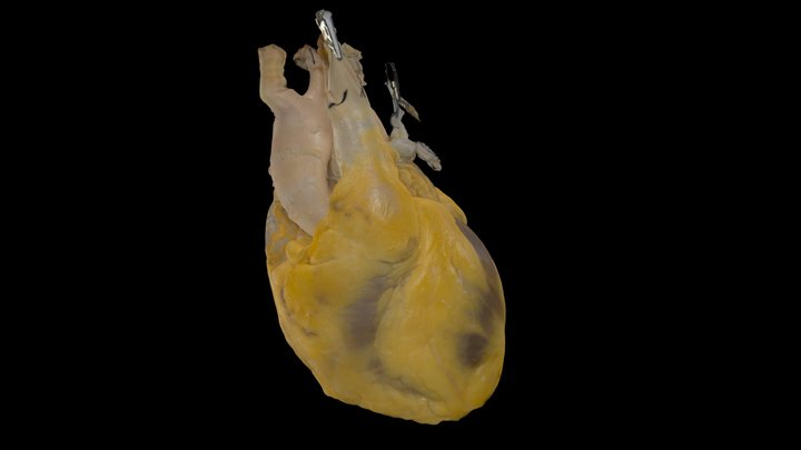 Cardiac_anatomy 3D models - Sketchfab