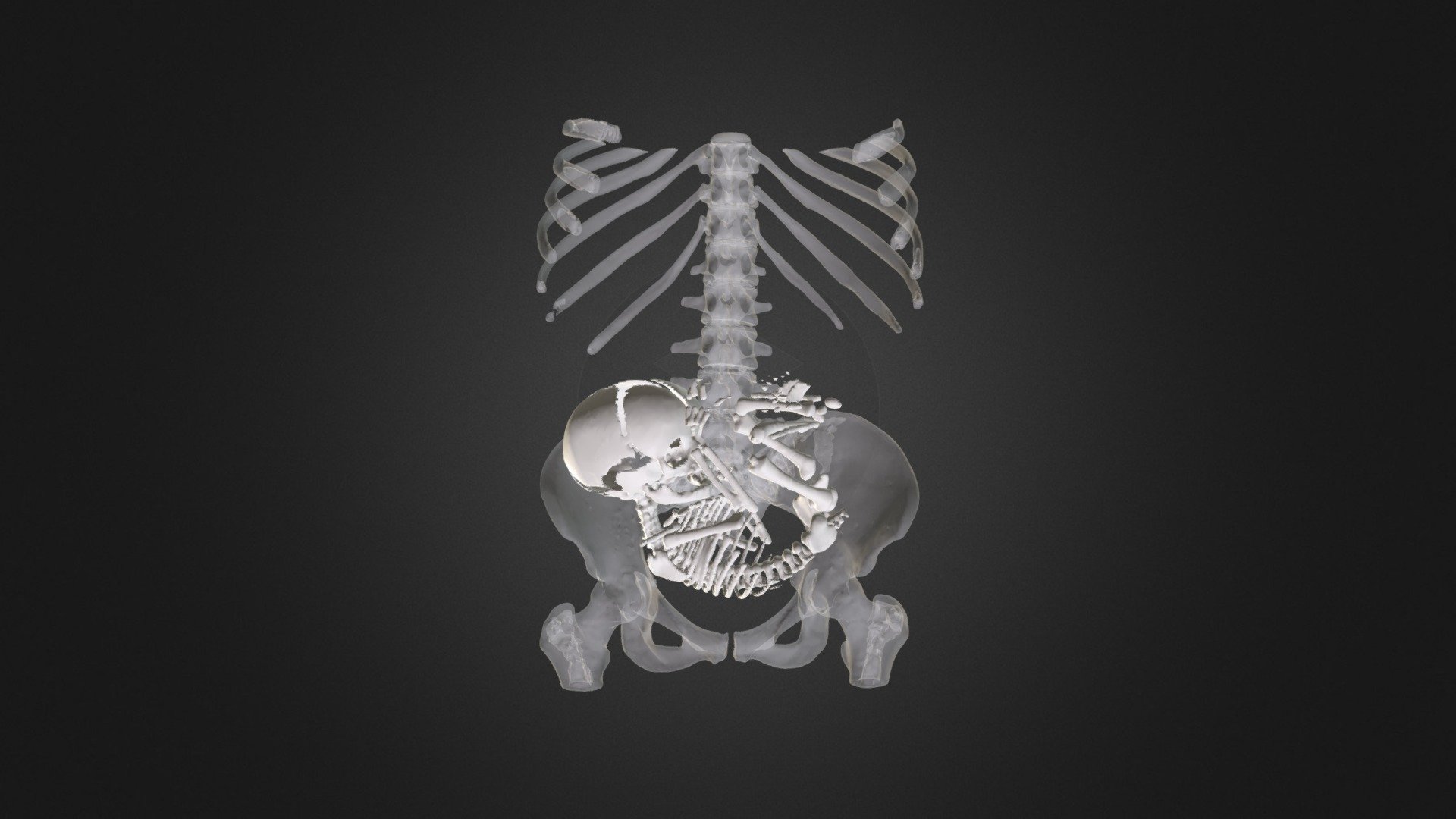 Maternal and Fetal Skeleton - 3D model by yuhuihuang [f6e5d12] - Sketchfab