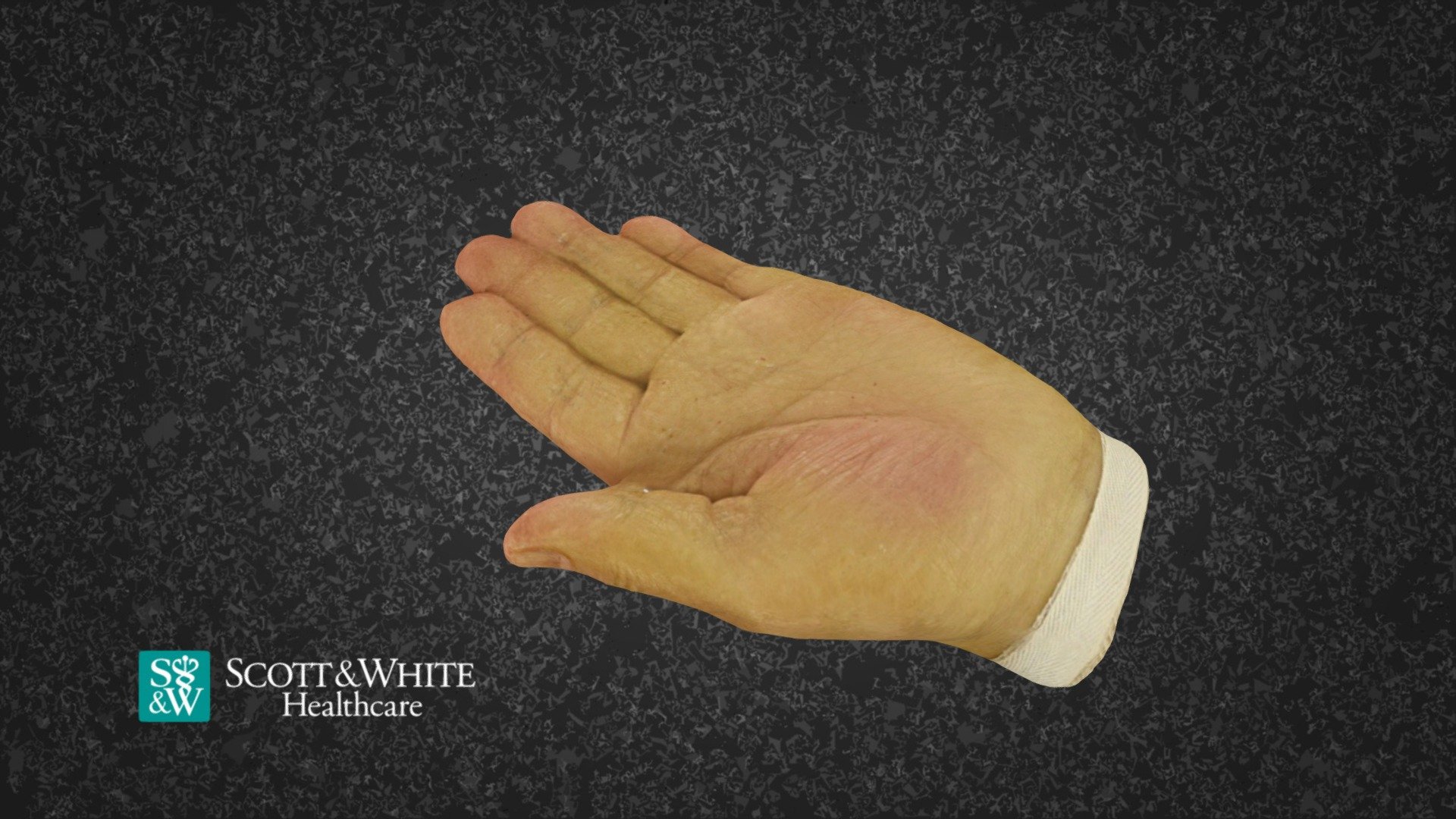 Hand- Raynaud's 183473 - 3D model by Scott & White Moulage Project ...