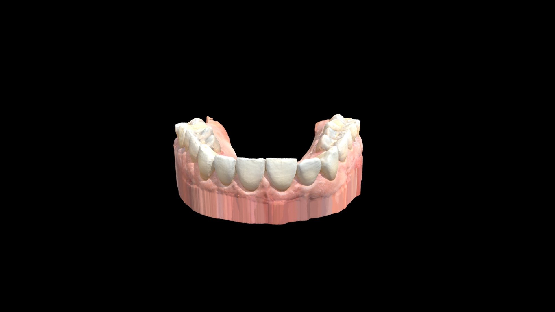 Empreinte Optique AK modèle haut - 3D model by vrdentaire (@tootyvr ...