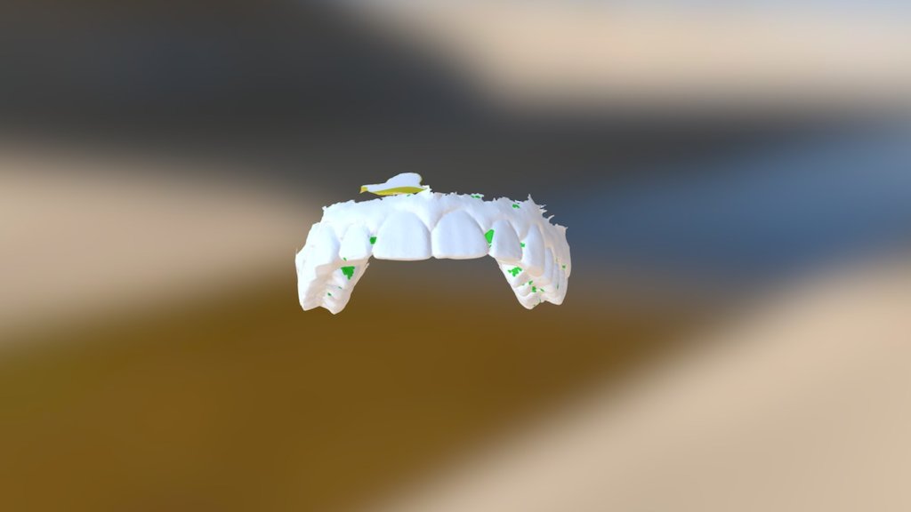 Upper Arch - 3D model by warrenday [f7523f1] - Sketchfab
