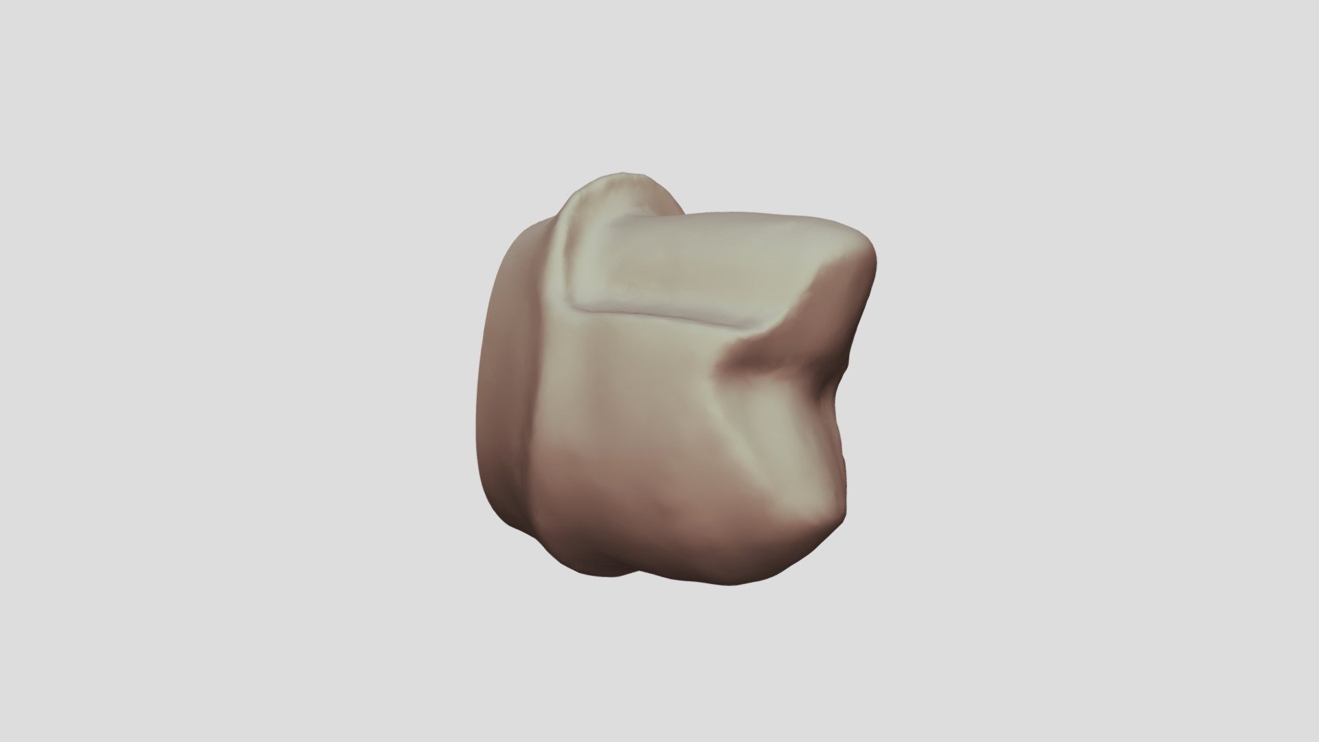 PFM - 3D model by VCU - Restorative Dentistry (@sodgp) [f77e69d ...