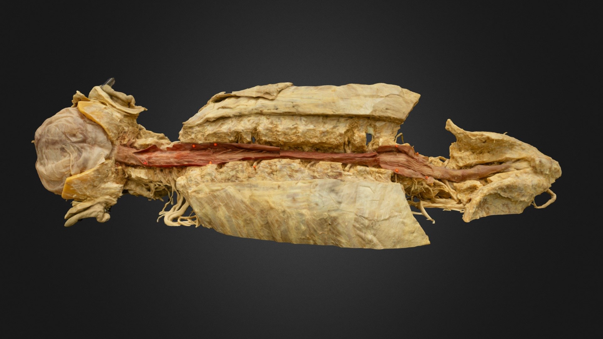 Spinal Cord - 3D model by UBC Medicine - Educational Media [f81b710 ...