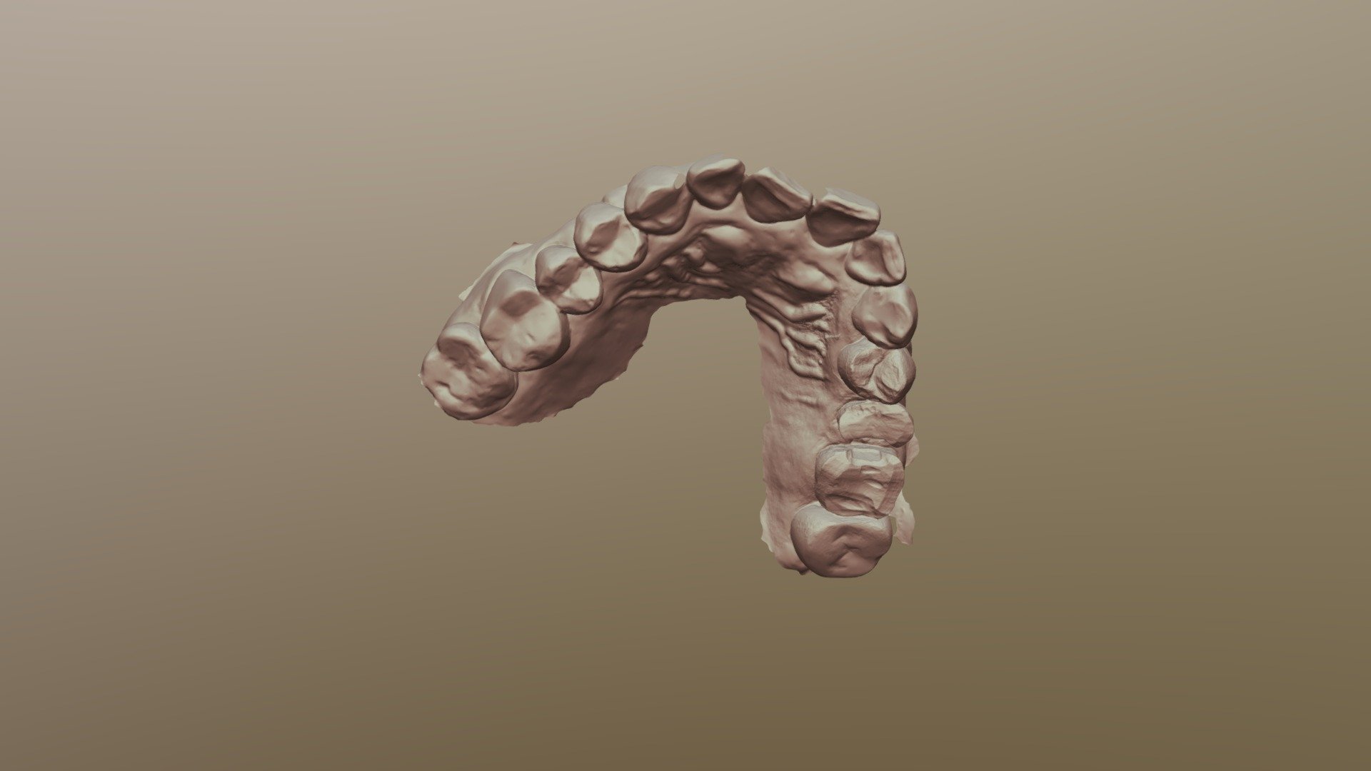 Upper Jaw Scan - 3D model by latte0126 [f85922b] - Sketchfab