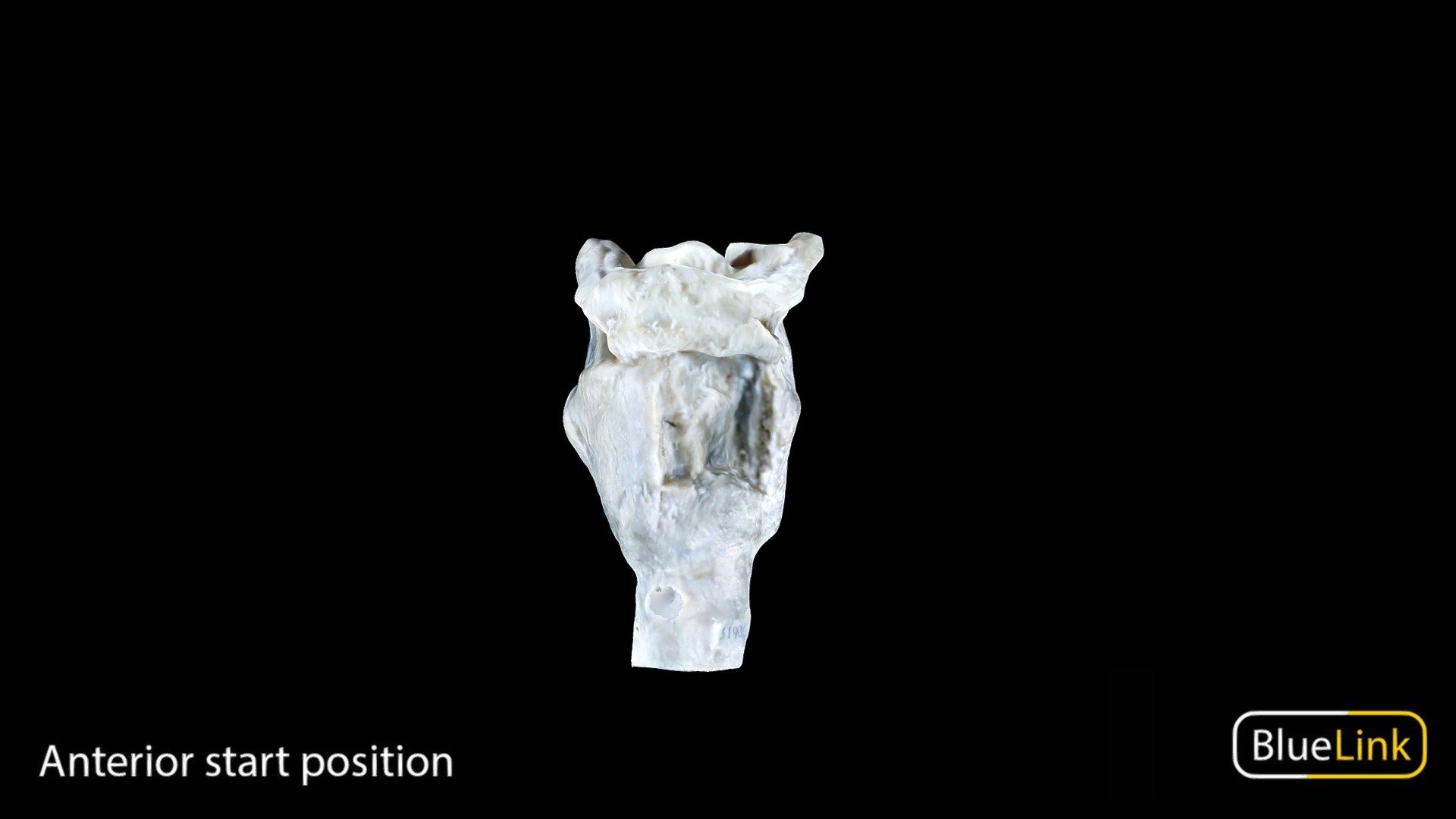 Larynx - 3D model by Bluelink Anatomy (@bluelinkanatomy) [f898dac ...