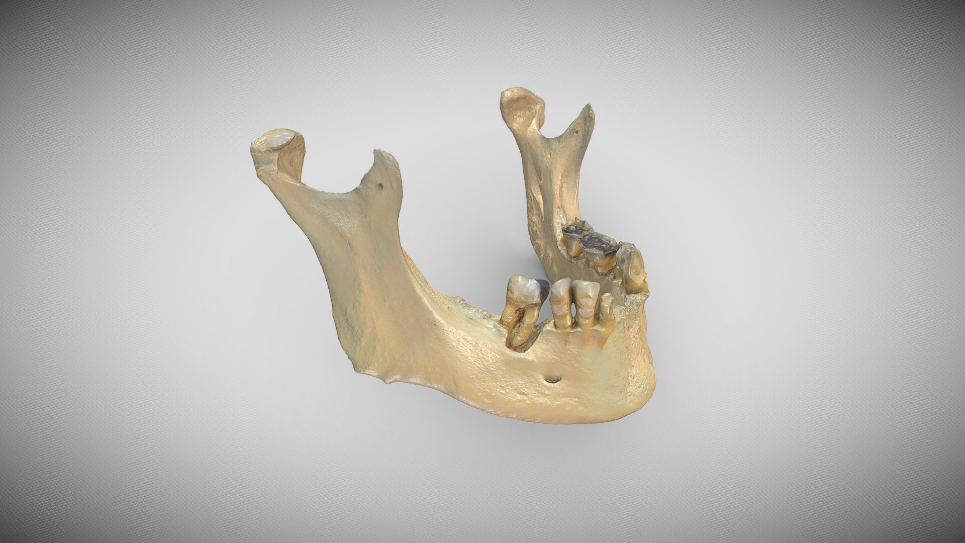 Mandibula - 3D model by Vida_Lab [f8ed381] - Sketchfab