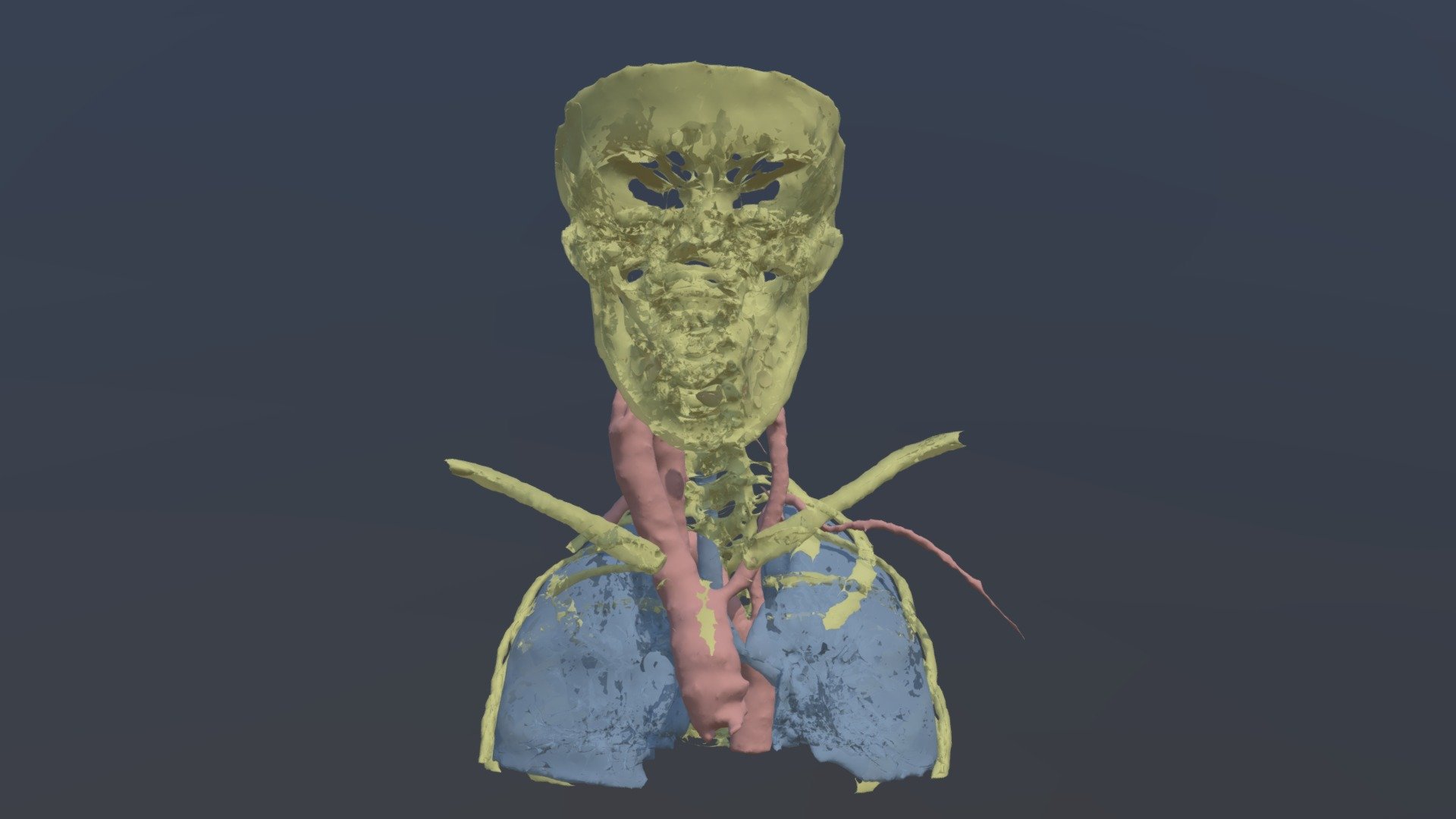 Cervical arch - 3D model by sarvpriya1985 [f8f04f7] - Sketchfab