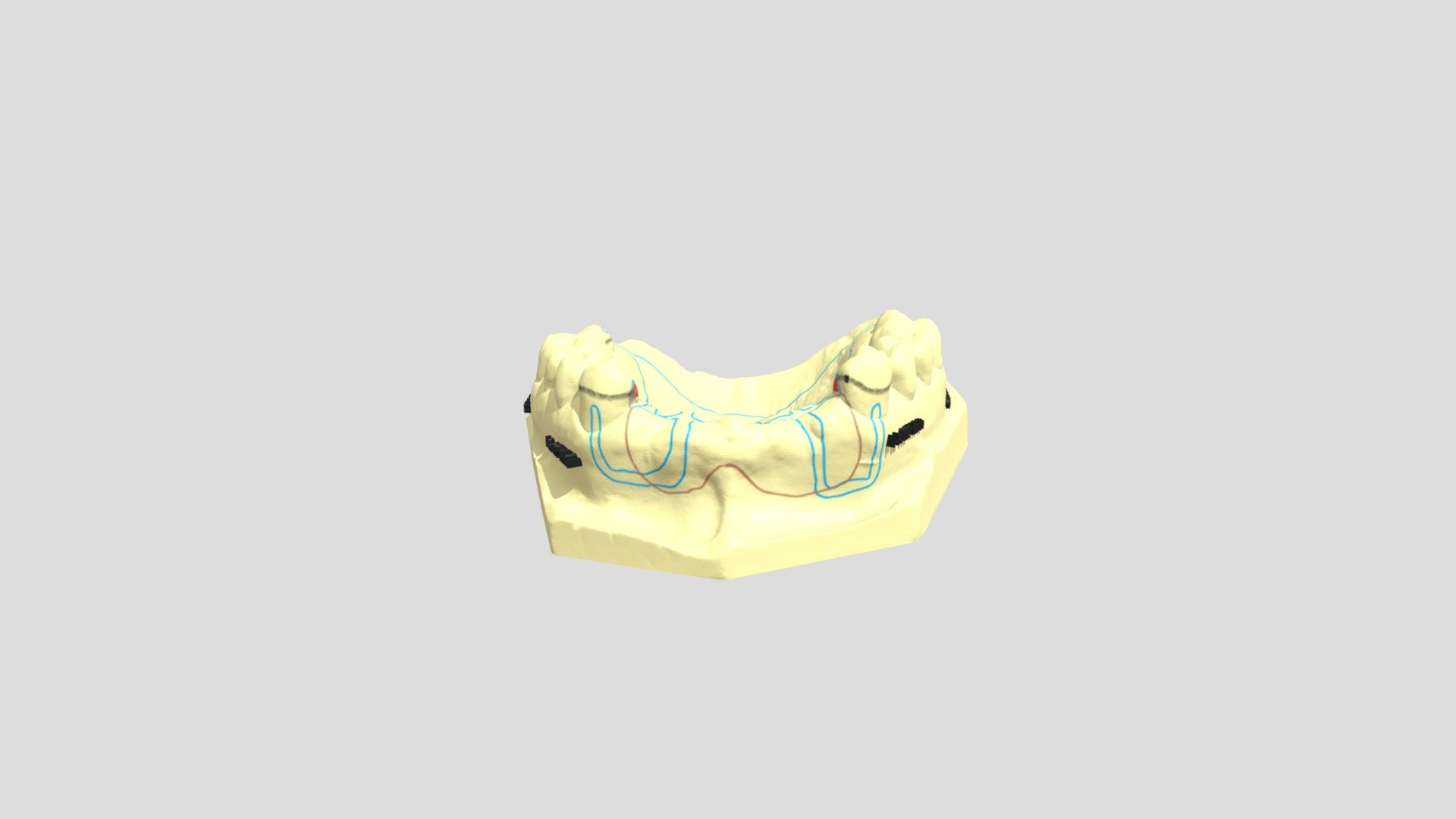 cast 8_stl - 3D model by Ahmed Mahrous (@drahedmahrous) [f9a54a8 ...