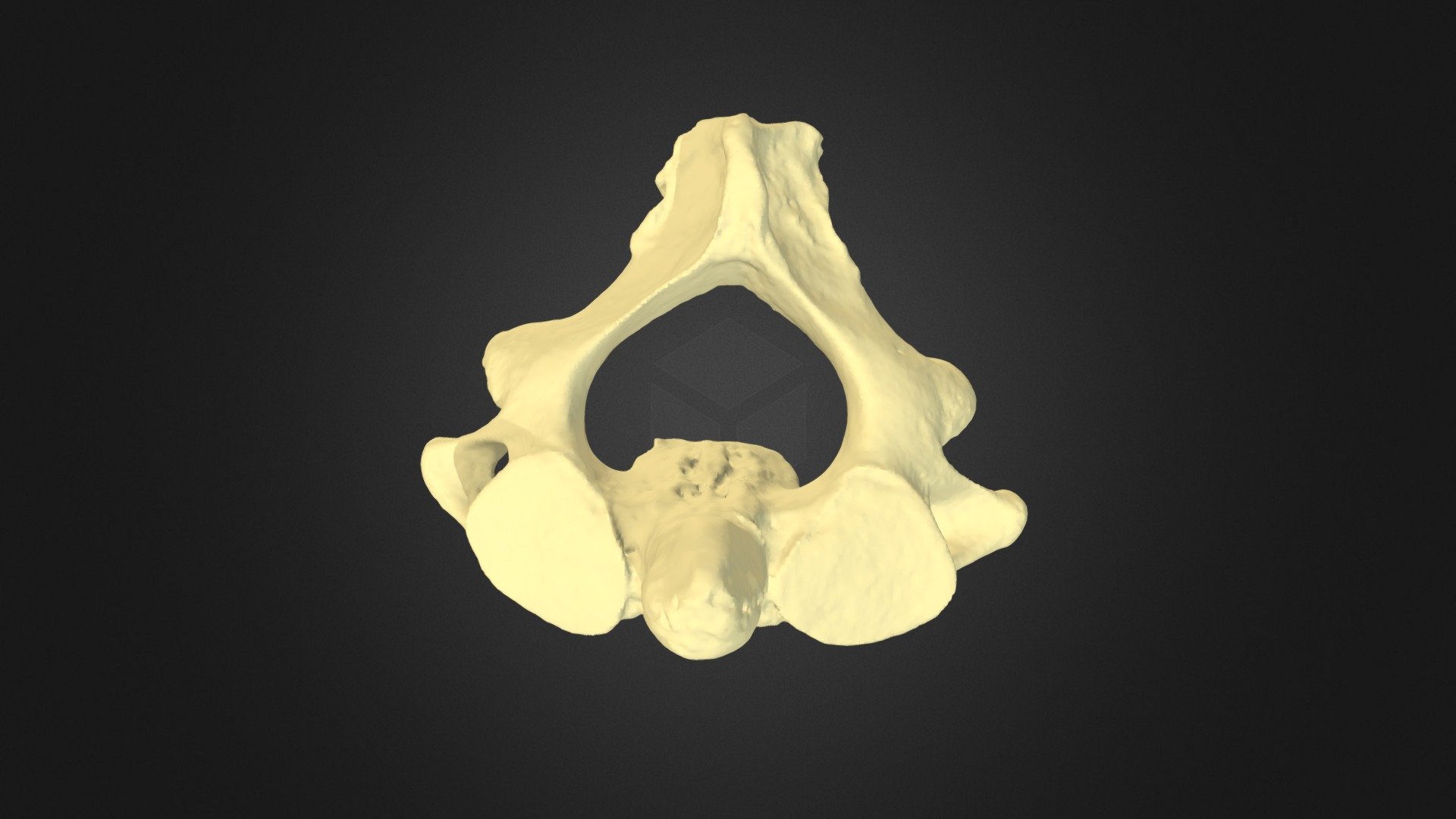 C2 Vertebra - 3D model by UBC Medicine - Educational Media [f9c5372 ...