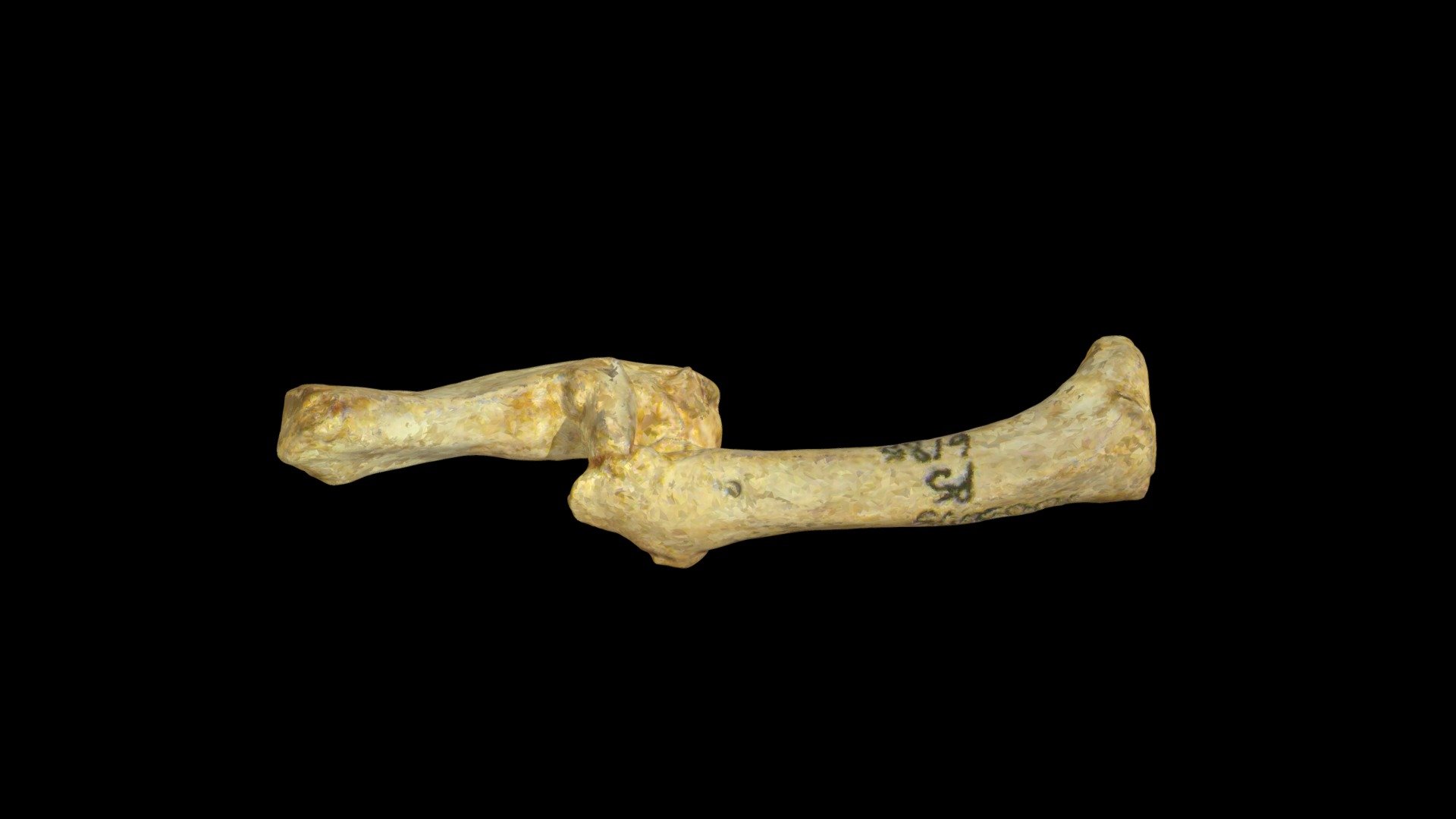 R Clavicle w Fracture (VCU_3D_3971) - 3D model by Virtual Curation Lab ...