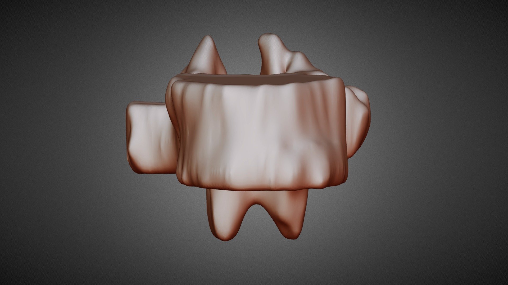 T12 Vertebrae 3D STL Model - 3D model by cszulkin [fa69554] - Sketchfab