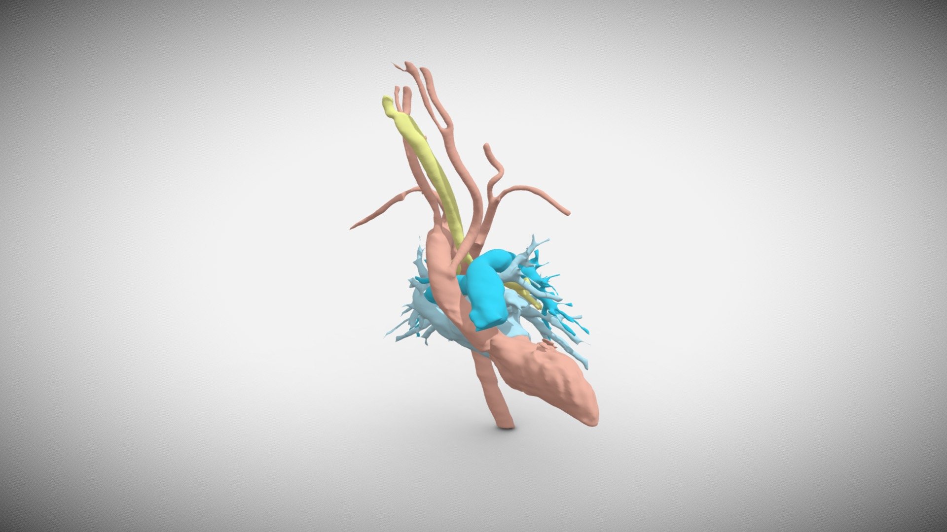 Vascular Ring - 3D model by Imre J. Barabás, MD, M.Sc. (@Uzzias18 ...