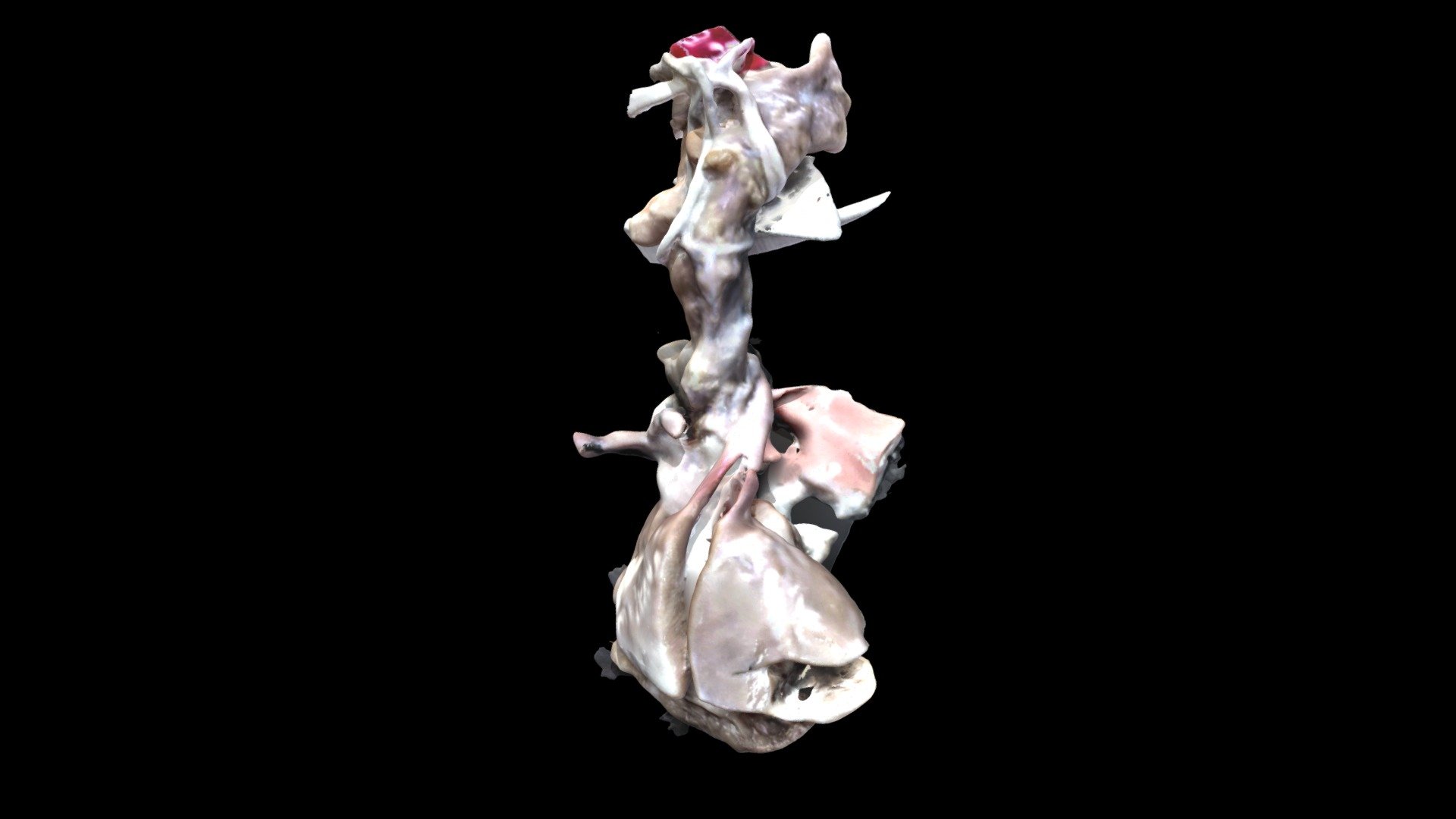 Vascular ring right aortic arch I-619 - 3D model by Rohit Loomba ...
