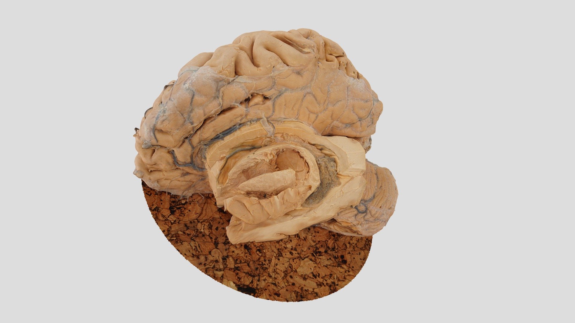 Brain - basal nuclei - 3D model by kucharm [fb60f33] - Sketchfab