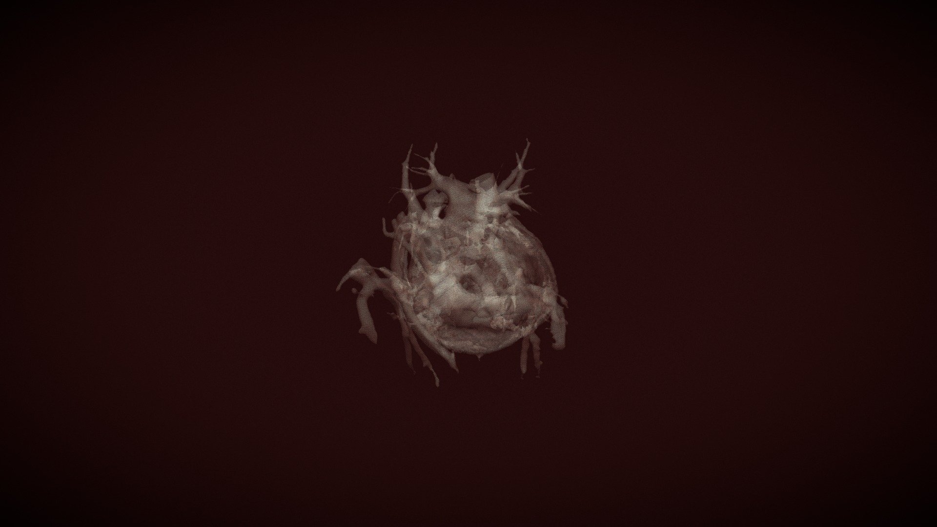 Abnormal: Heart - Download Free 3D model by Amogh Batwal (@amoghbatwal ...