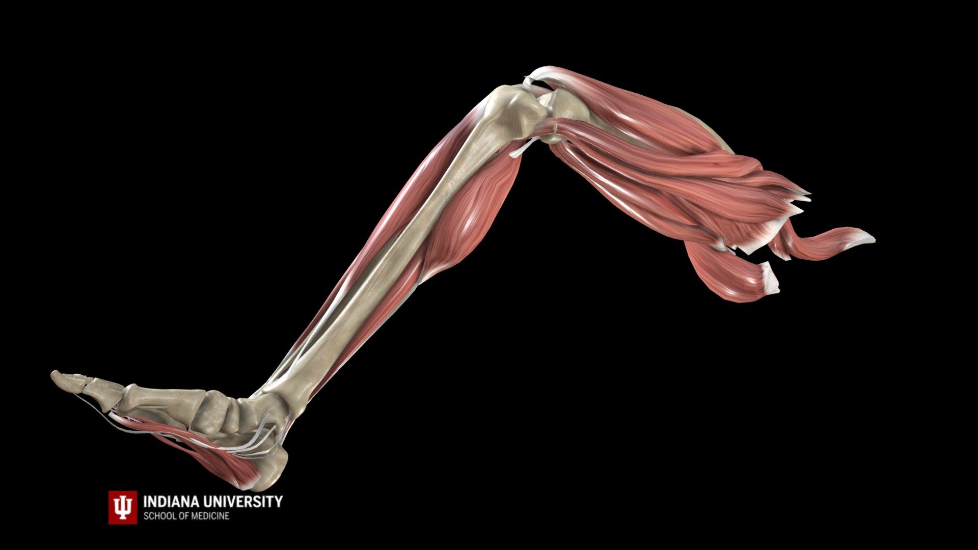 Knee - ACL: Anterior Drawer - Female - 3D model by IU Indianapolis ...
