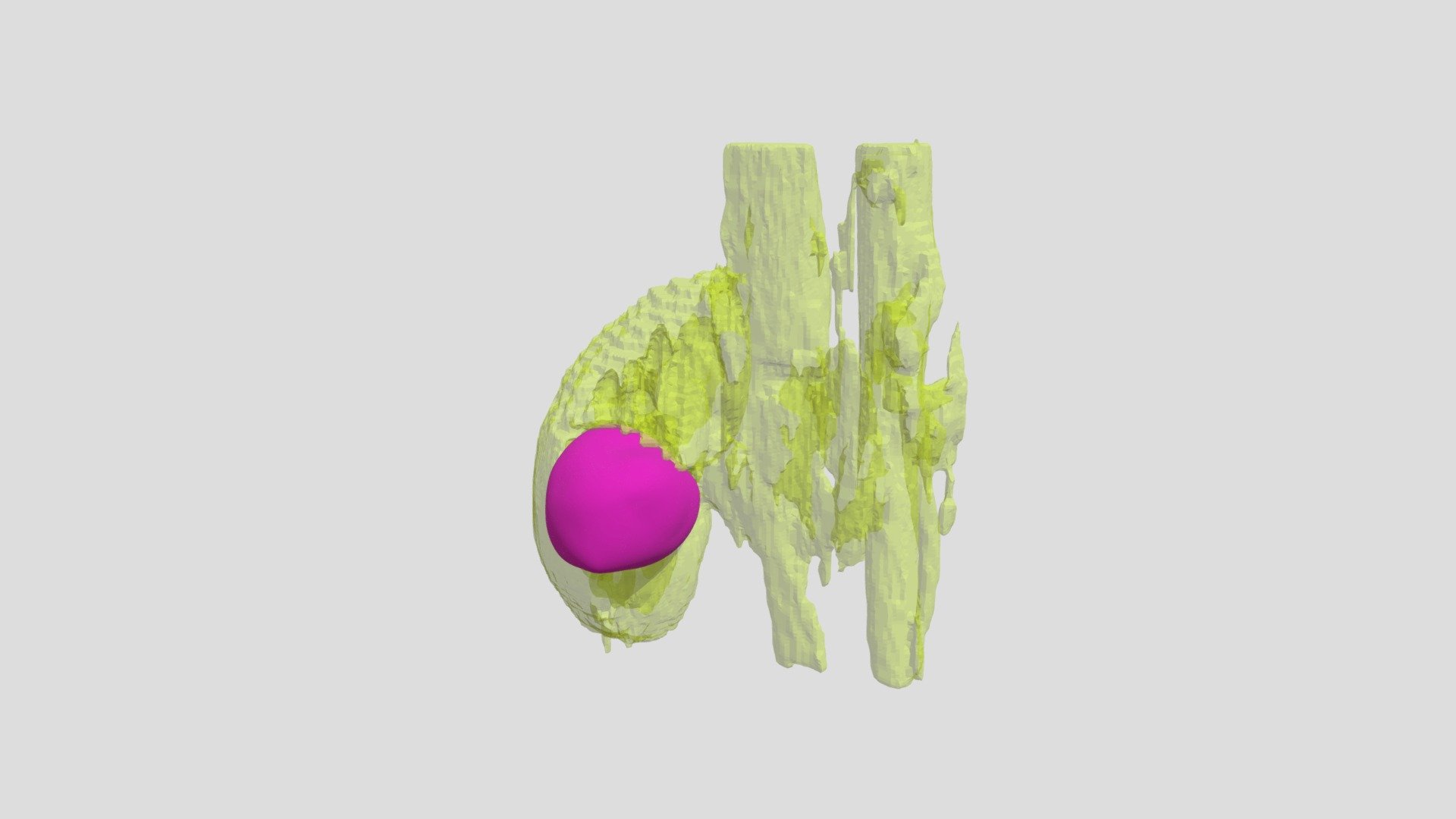Andre_Matos_30_05_2021 - Download Free 3D model by augenmed [fc1c43d ...