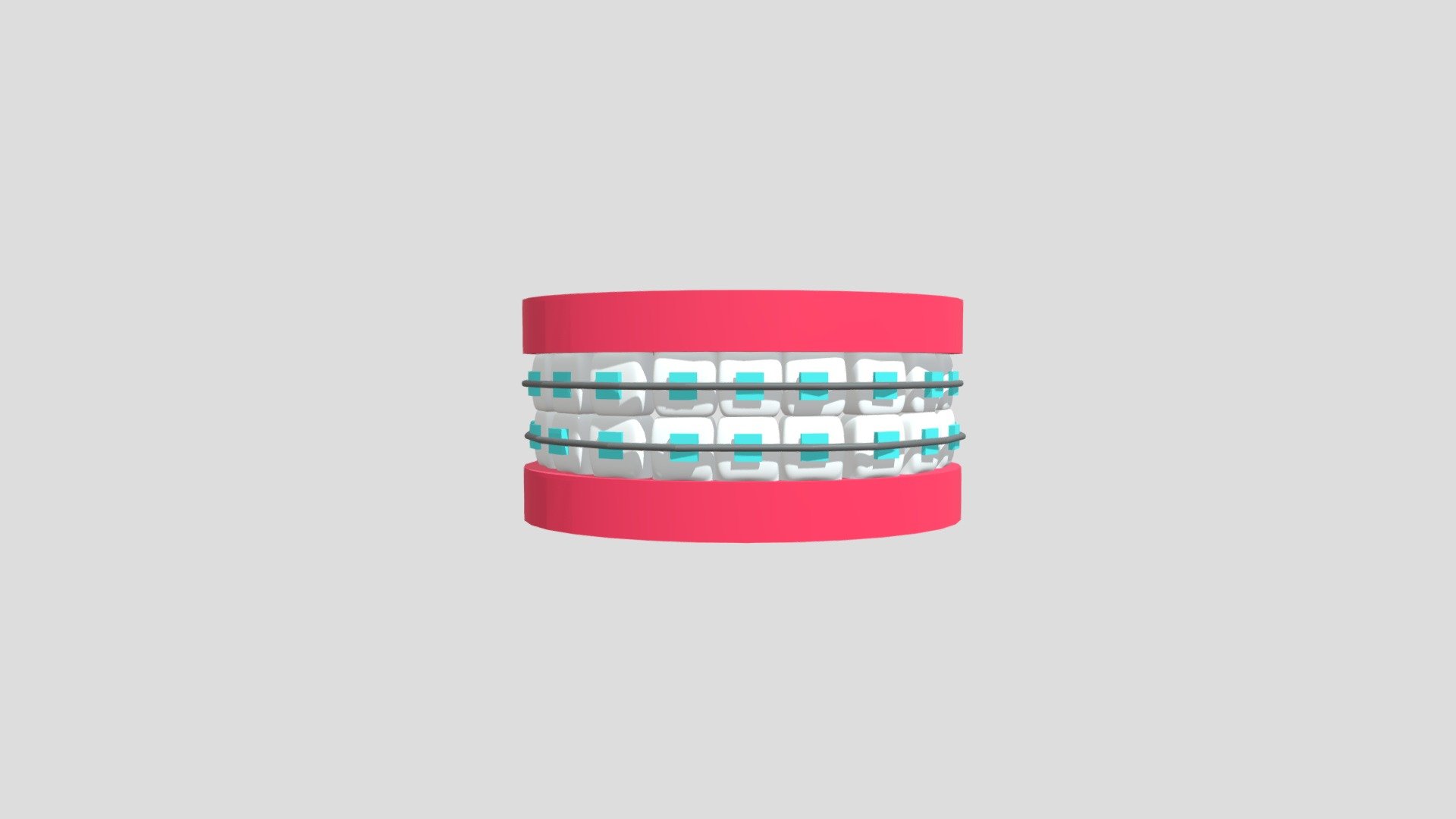 teeth braces - Download Free 3D model by timmy (@timislav845455 ...