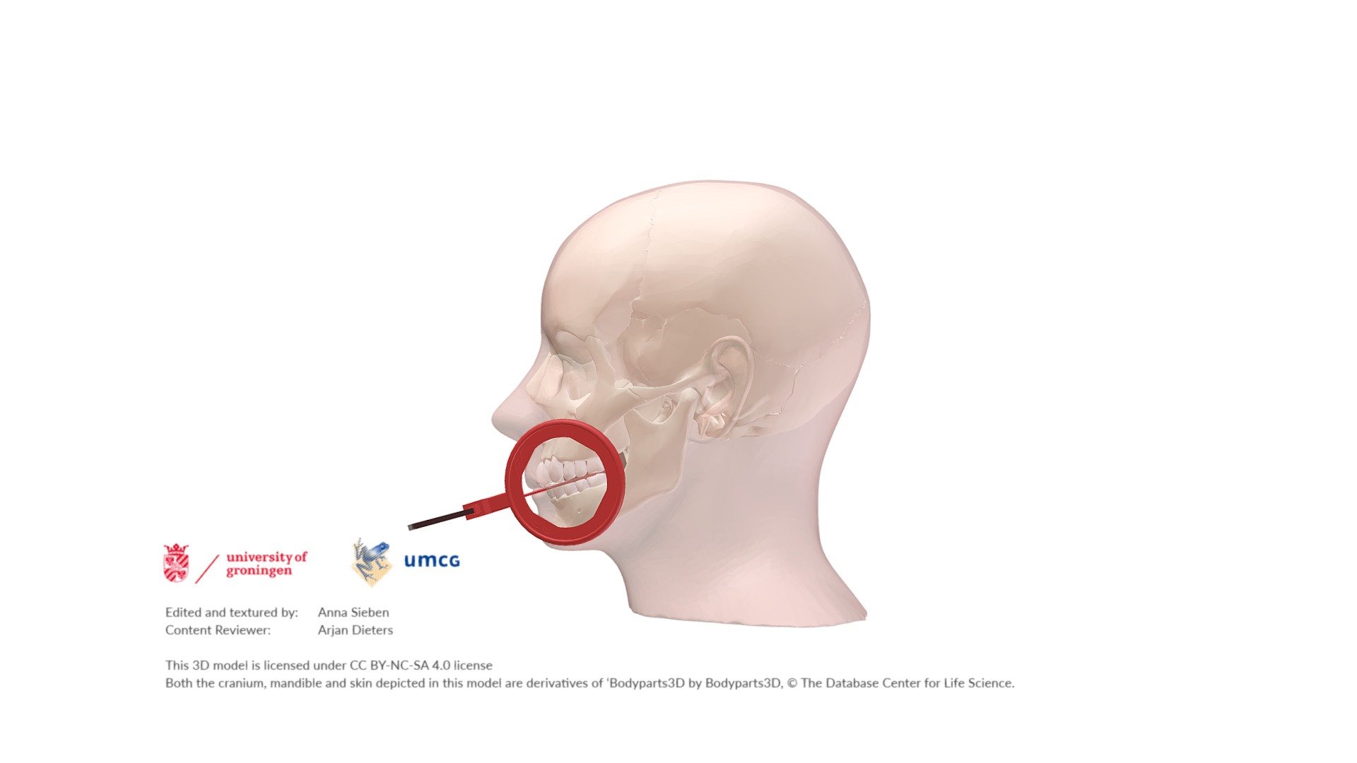 Dental Intra Oral X-ray Positioner, Bite-wing - Download Free 3D model ...