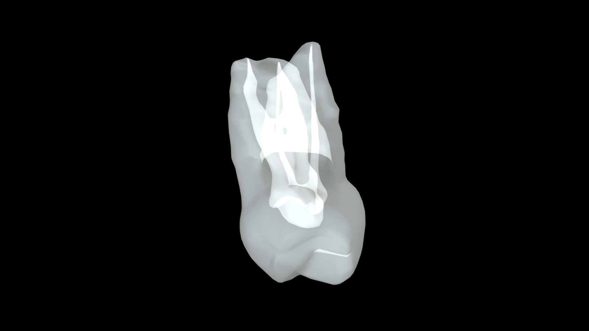 Tooth 14-B - 3D model by biomed3d [fccb5f4] - Sketchfab