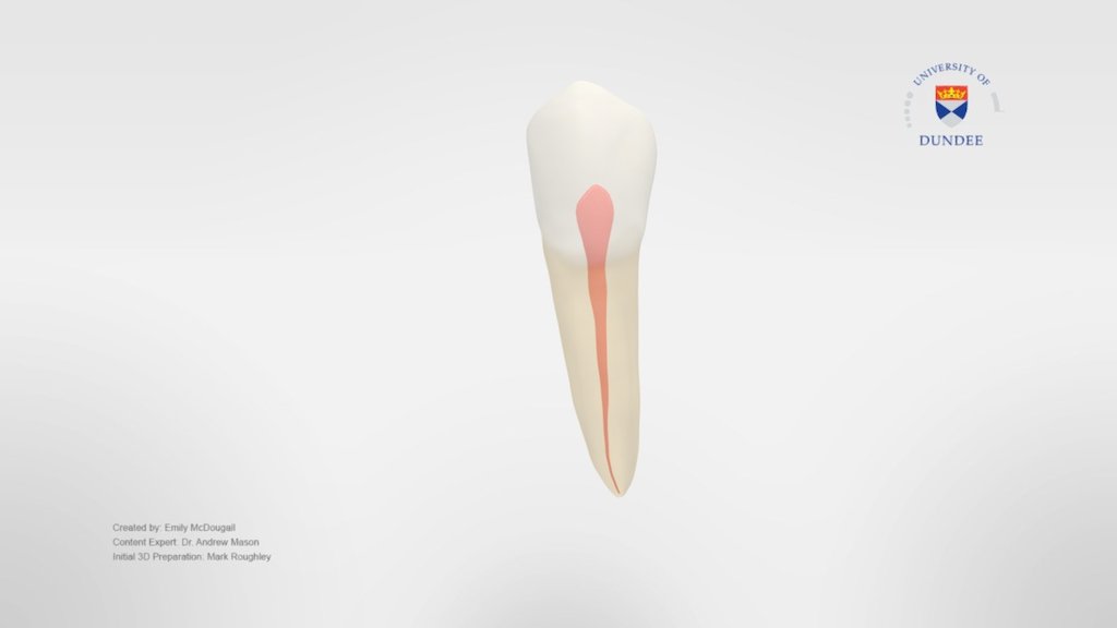 Mandibular Canine - Endodontic - 3D model by University of Dundee ...