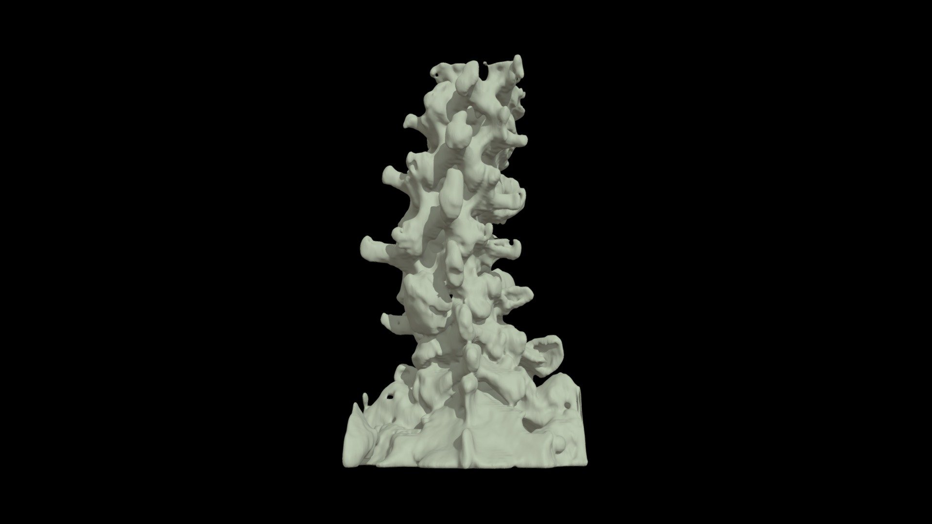 Lumbar Severe Degen - 3D model by Justin Cramer (@jcramer) [fd394c9 ...