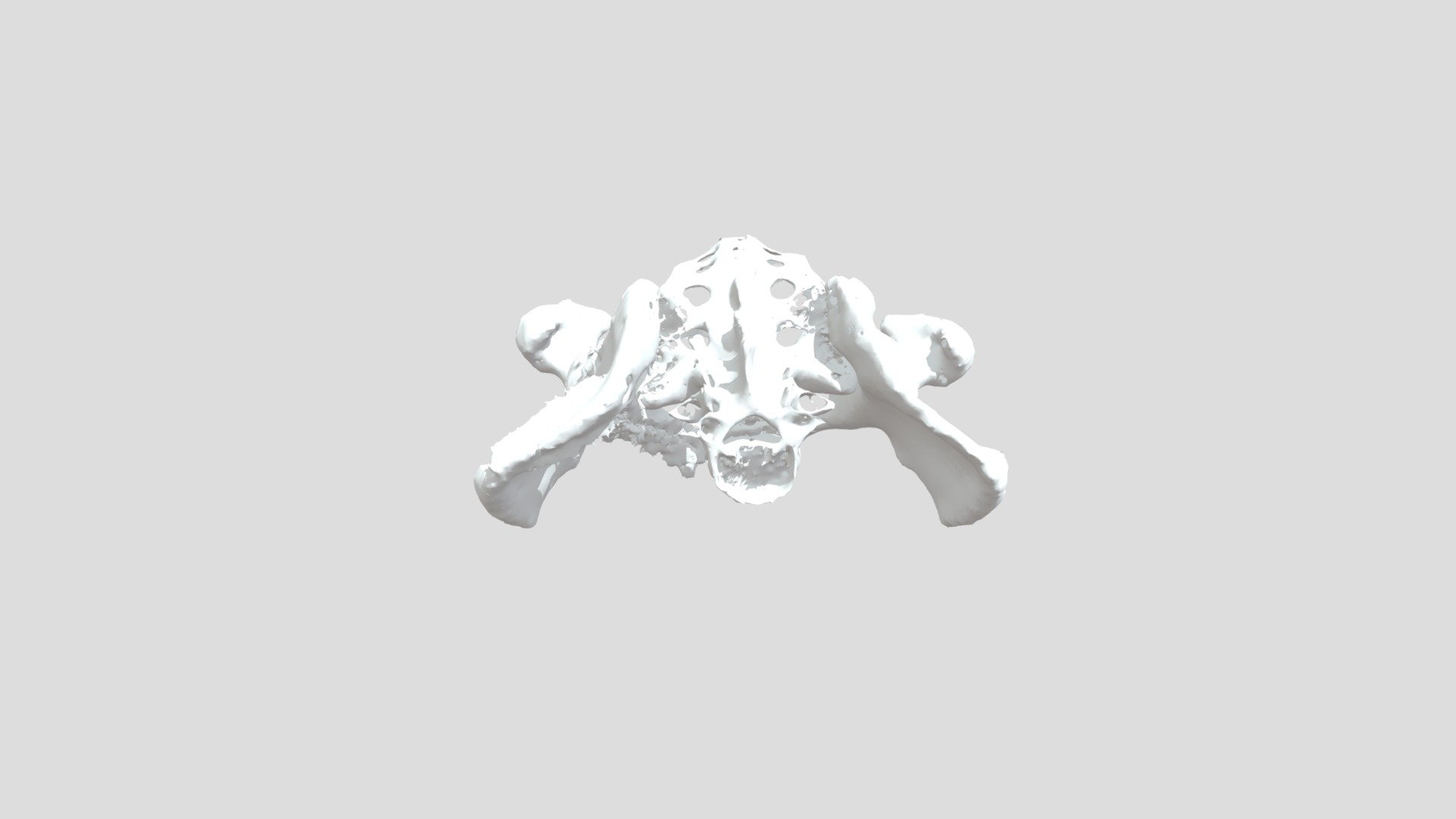 Broken pelvis - 3D model by michbui [fd3c345] - Sketchfab