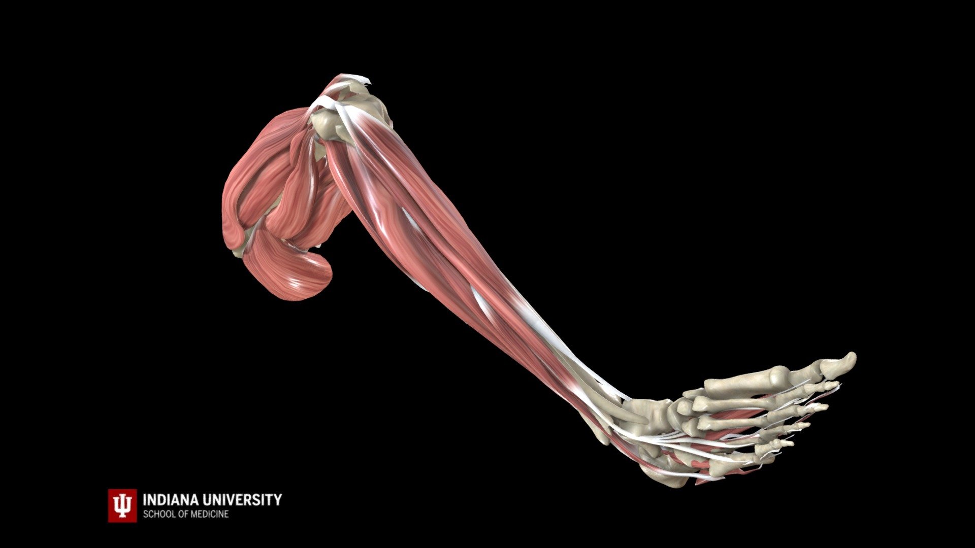 Knee - Varus Stress Test - Female - 3D model by IU Indianapolis ...