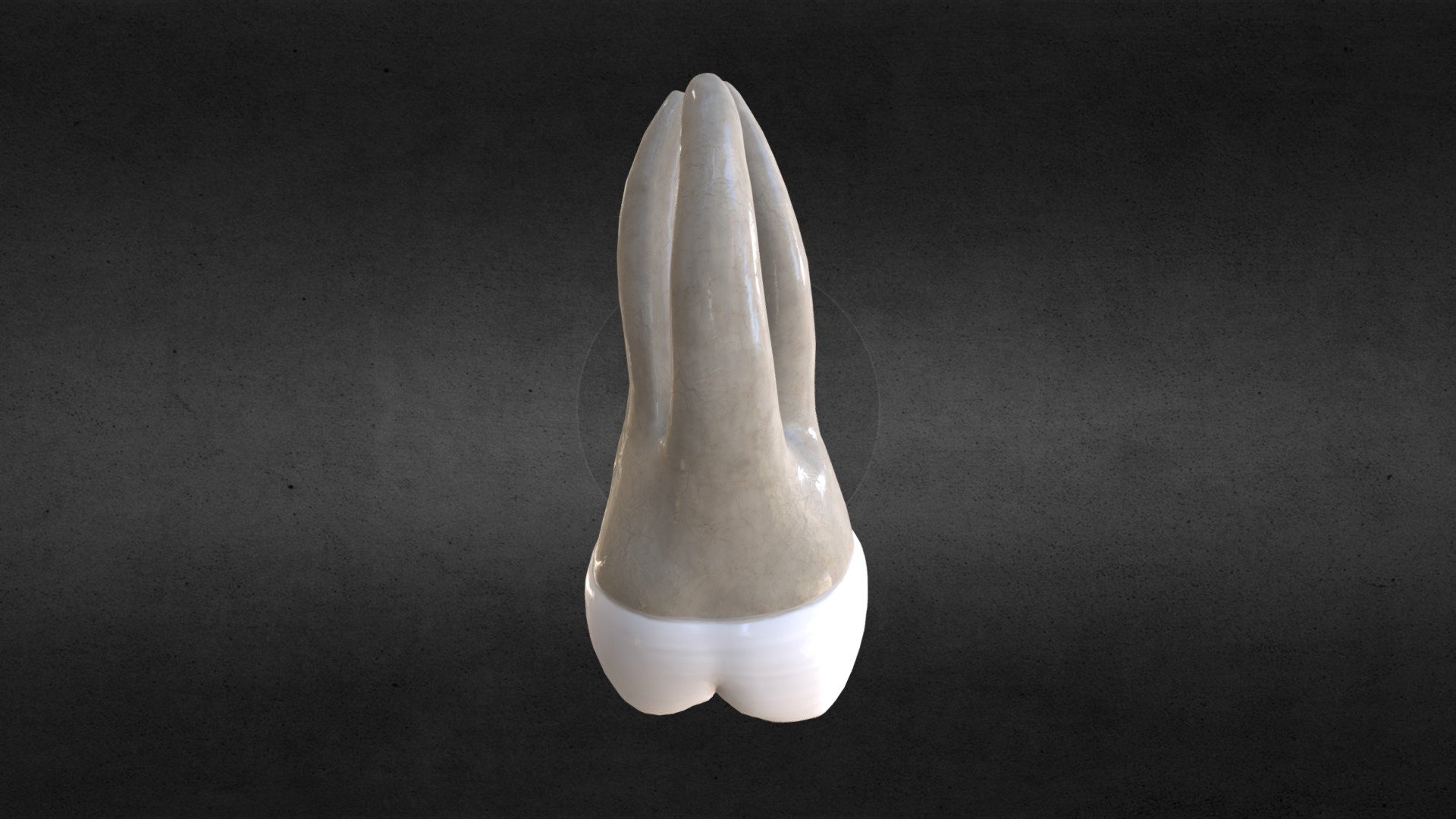 Upper Third Molar - 3D model by Ronaldo.Ribeiro.da.Silva [fd8c579 ...