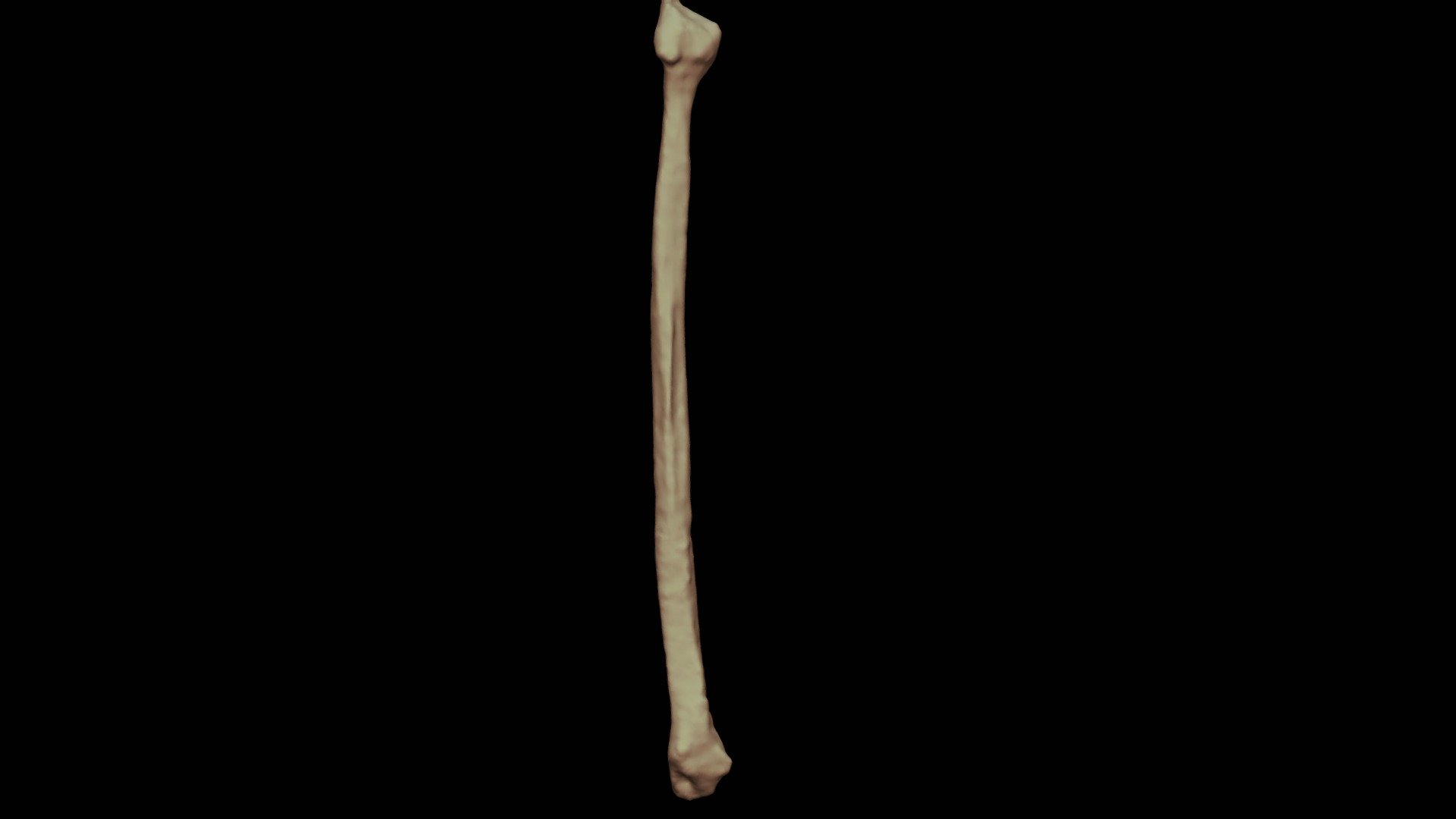 Fibula - 3D model by Prof. Serge VAN SINT JAN - Univ. Libre Bruxelles ...