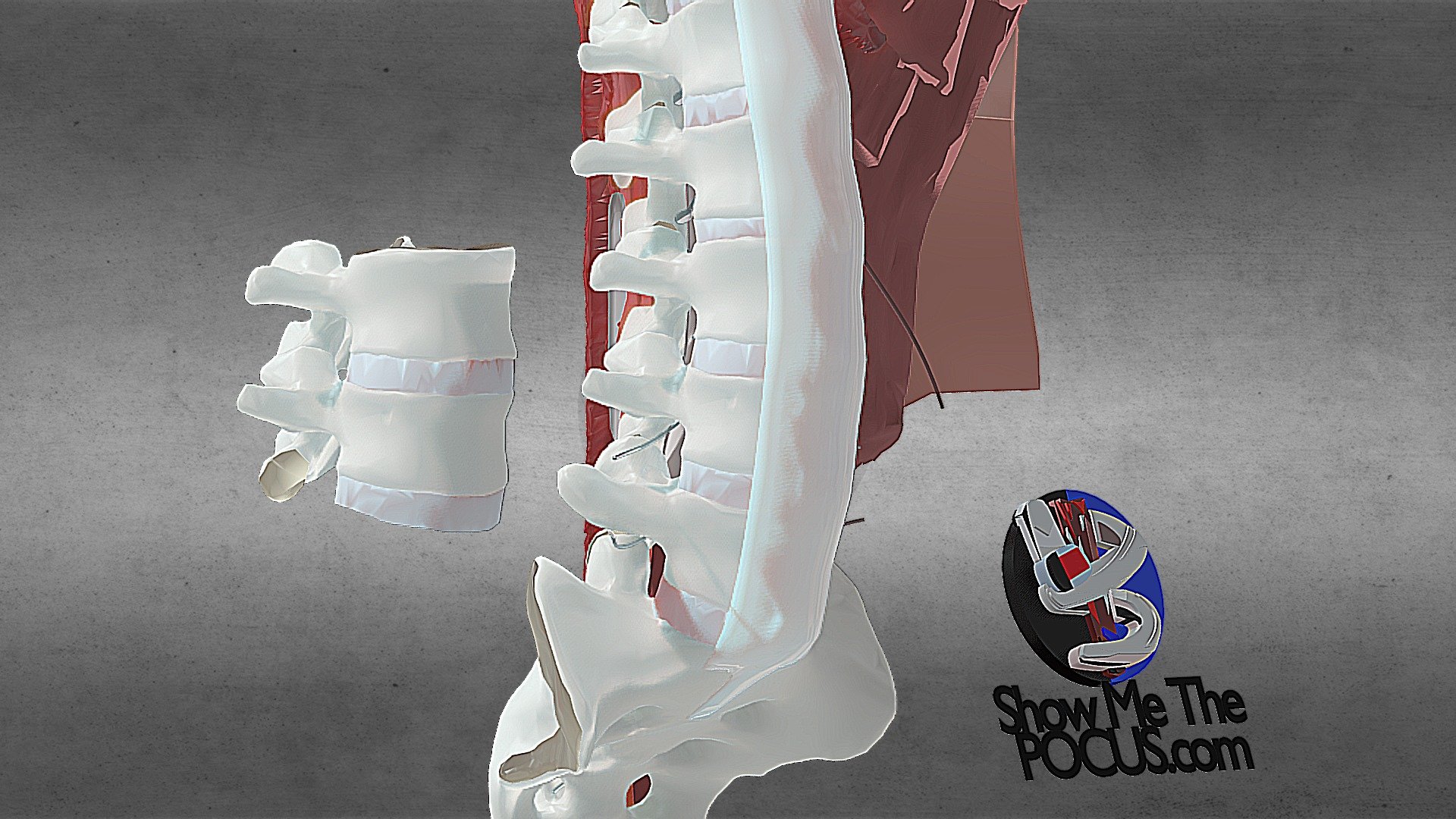 Lumbar anatomy from showmethepocus.com - 3D model by showmethepocus ...