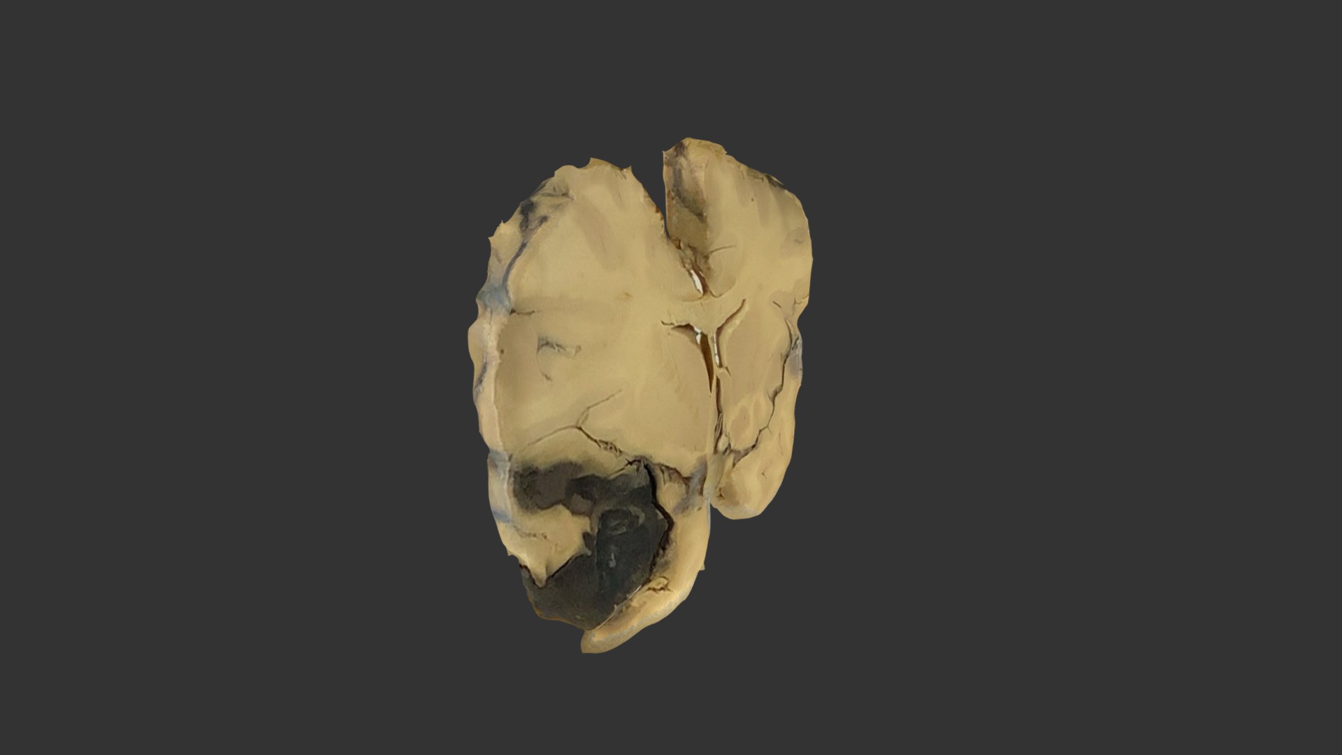 Corte Coronal CM - 3D model by Carlos Salas (@chalesv) [fe3b952 ...