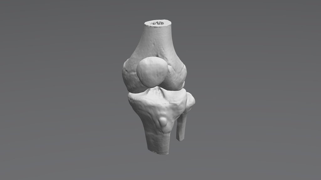 Full Knee - 3D model by Clínica 3D (@clinica3d) [fe90ead] - Sketchfab