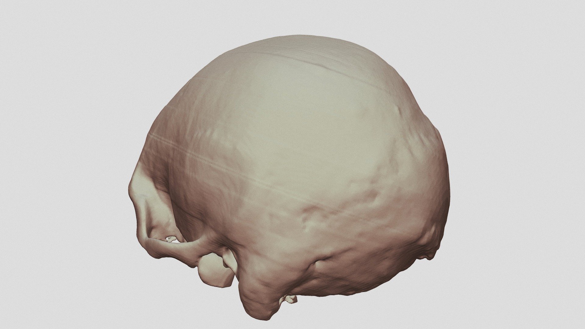 Skull Trauma - Download Free 3D model by Wayne Canada (@wayne5000 ...